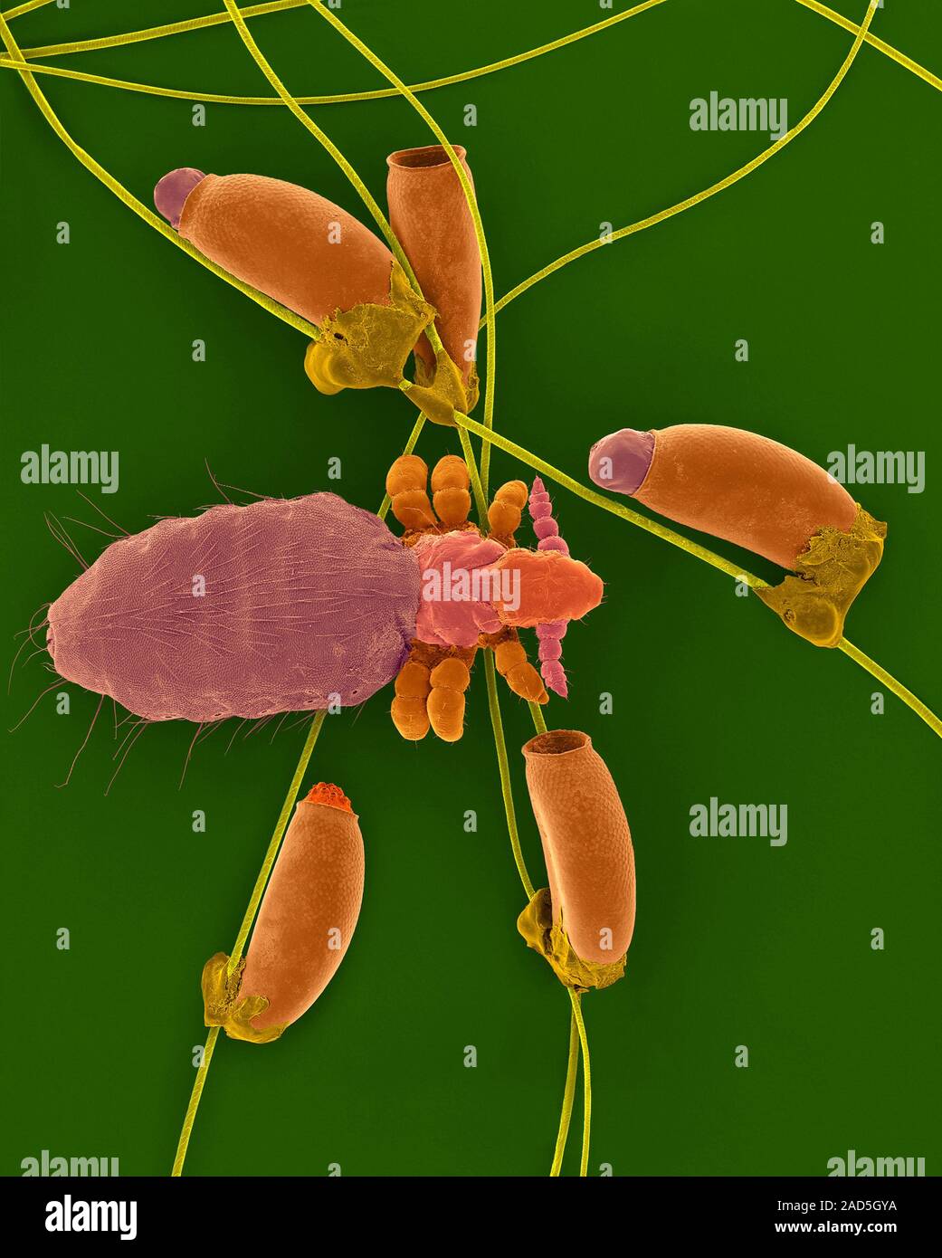 Coloured scanning electron micrograph (SEM) of Long-nosed cattle louse ...