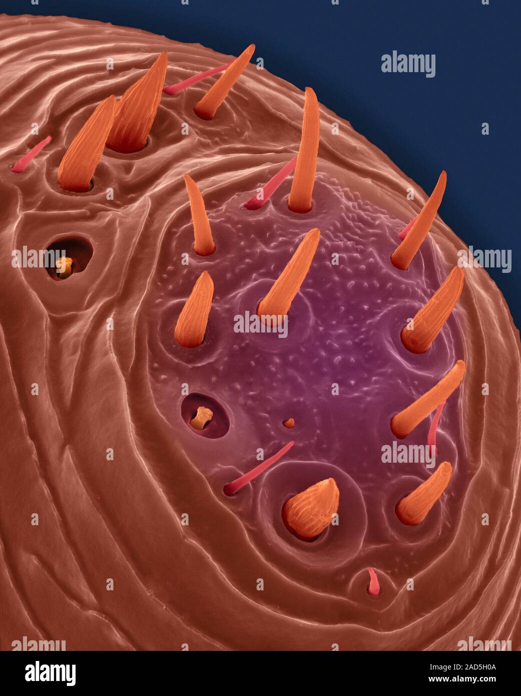 Coloured scanning electron micrograph (SEM) of Chicken body louse ...