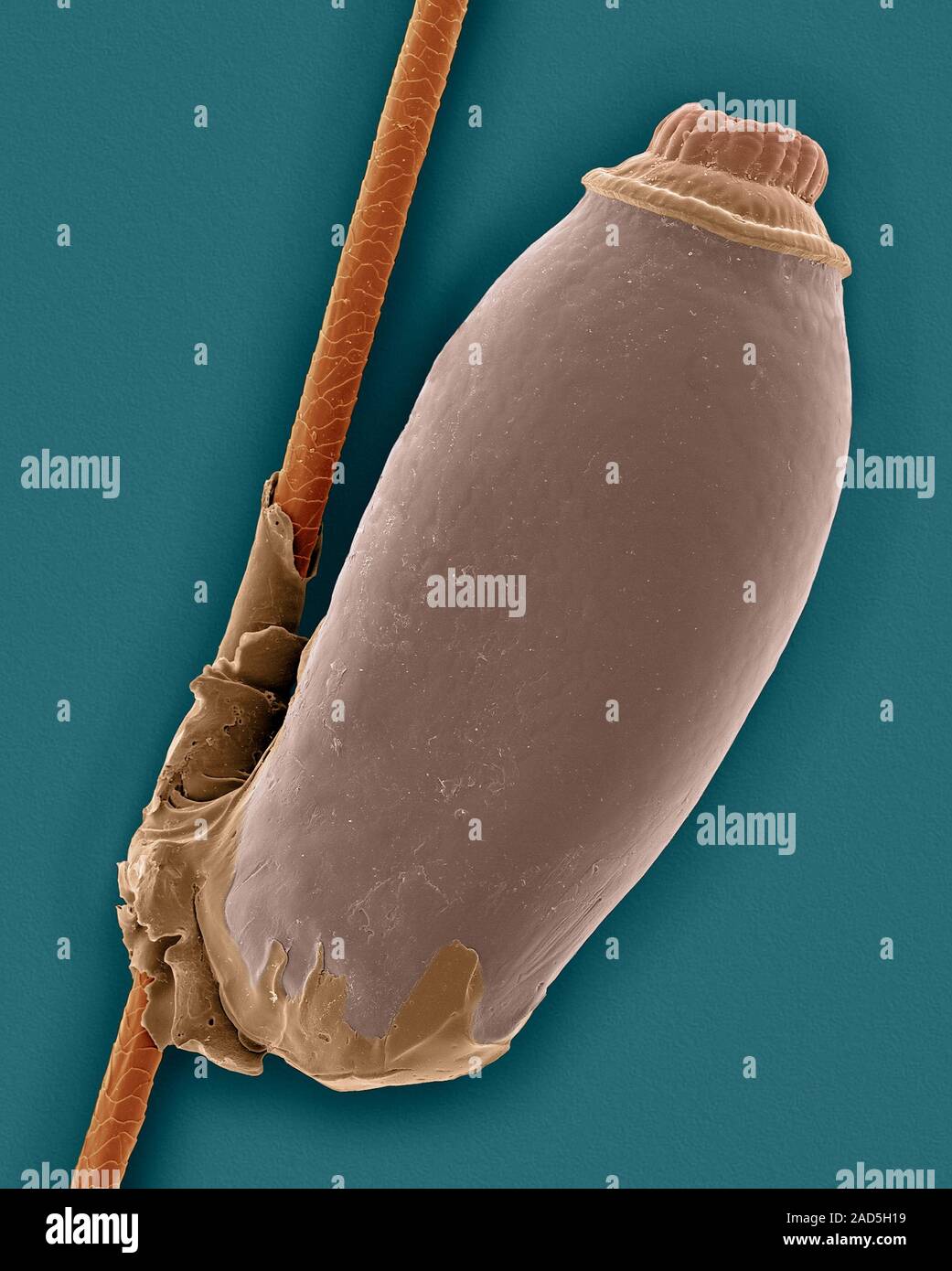 Coloured scanning electron micrograph (SEM) of Dog biting louse egg ...