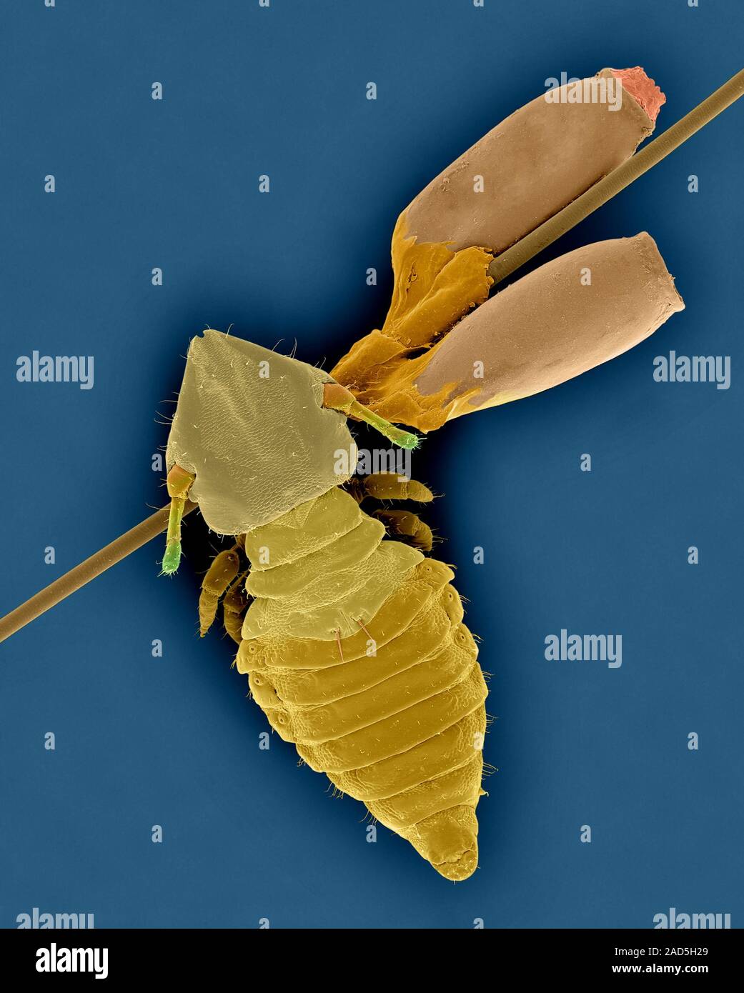 Coloured scanning electron micrograph (SEM) of Cat biting louse and egg ...