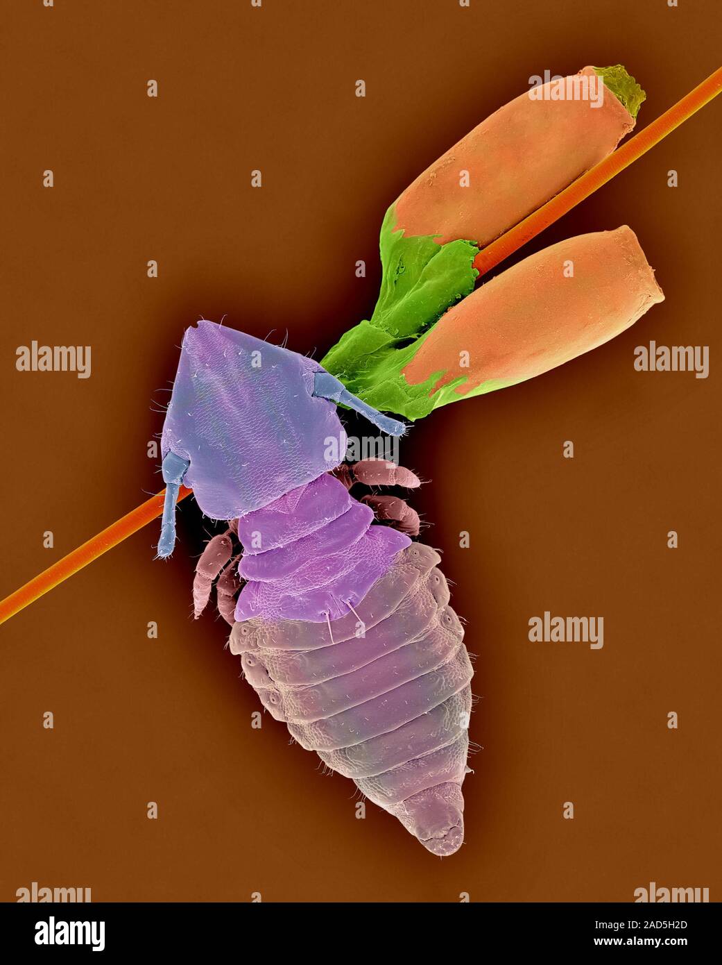 Coloured scanning electron micrograph (SEM) of Cat biting louse and egg ...