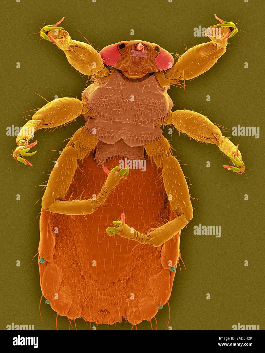 Coloured scanning electron micrograph (SEM) of Deer louse fly adult ...