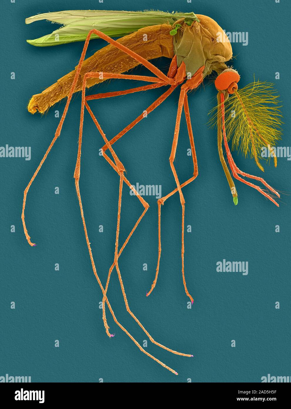 Coloured scanning electron micrograph (SEM) of Male common house ...