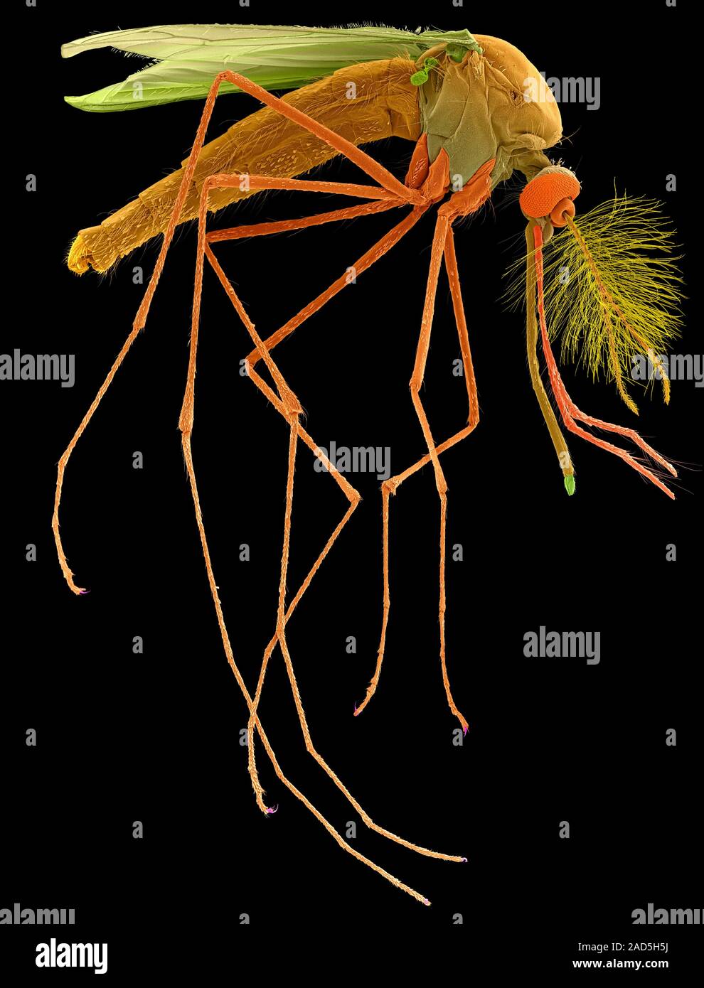 Coloured scanning electron micrograph (SEM) of Male common house ...