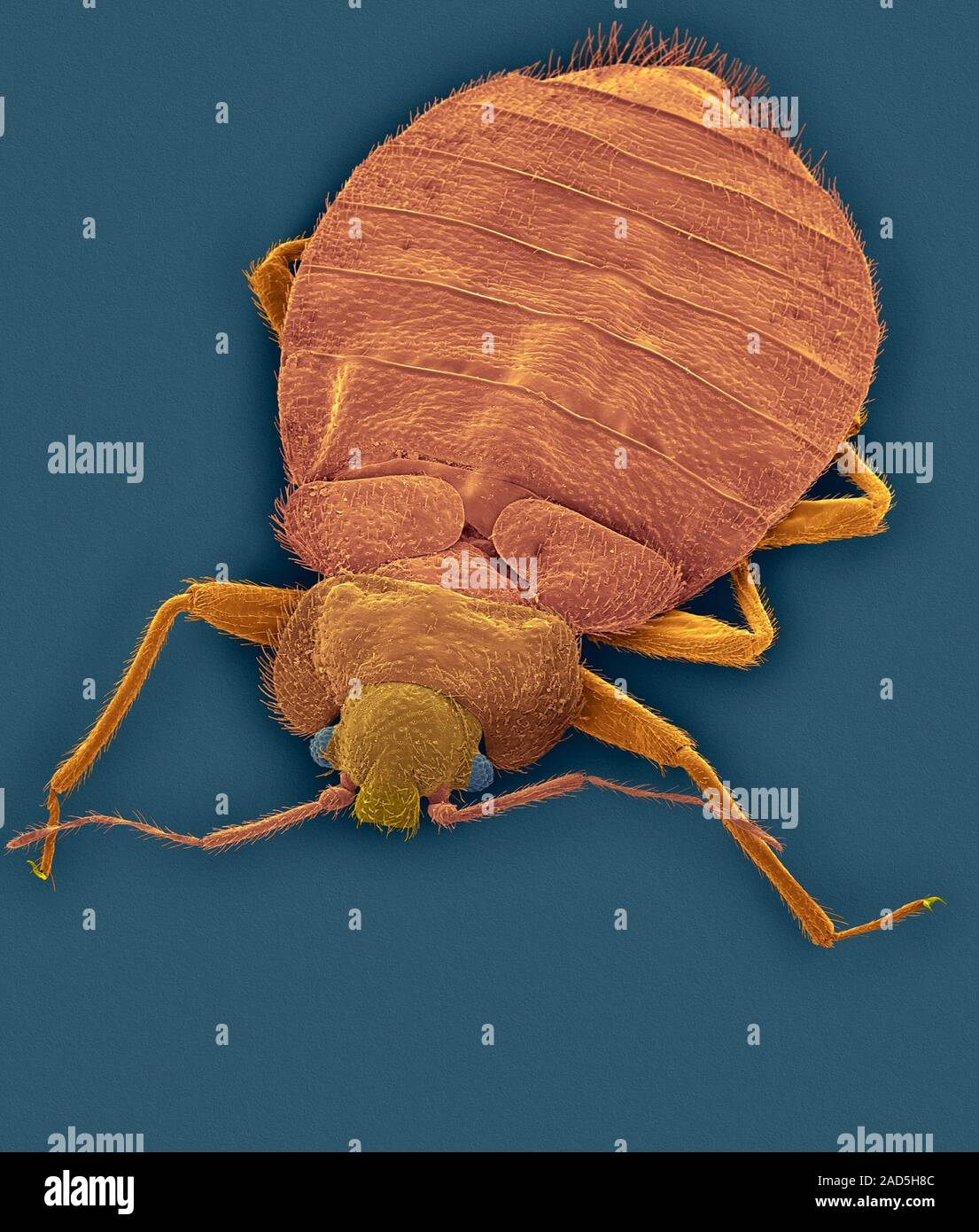 Coloured scanning electron micrograph (SEM) of Bed bug (Cimex ...