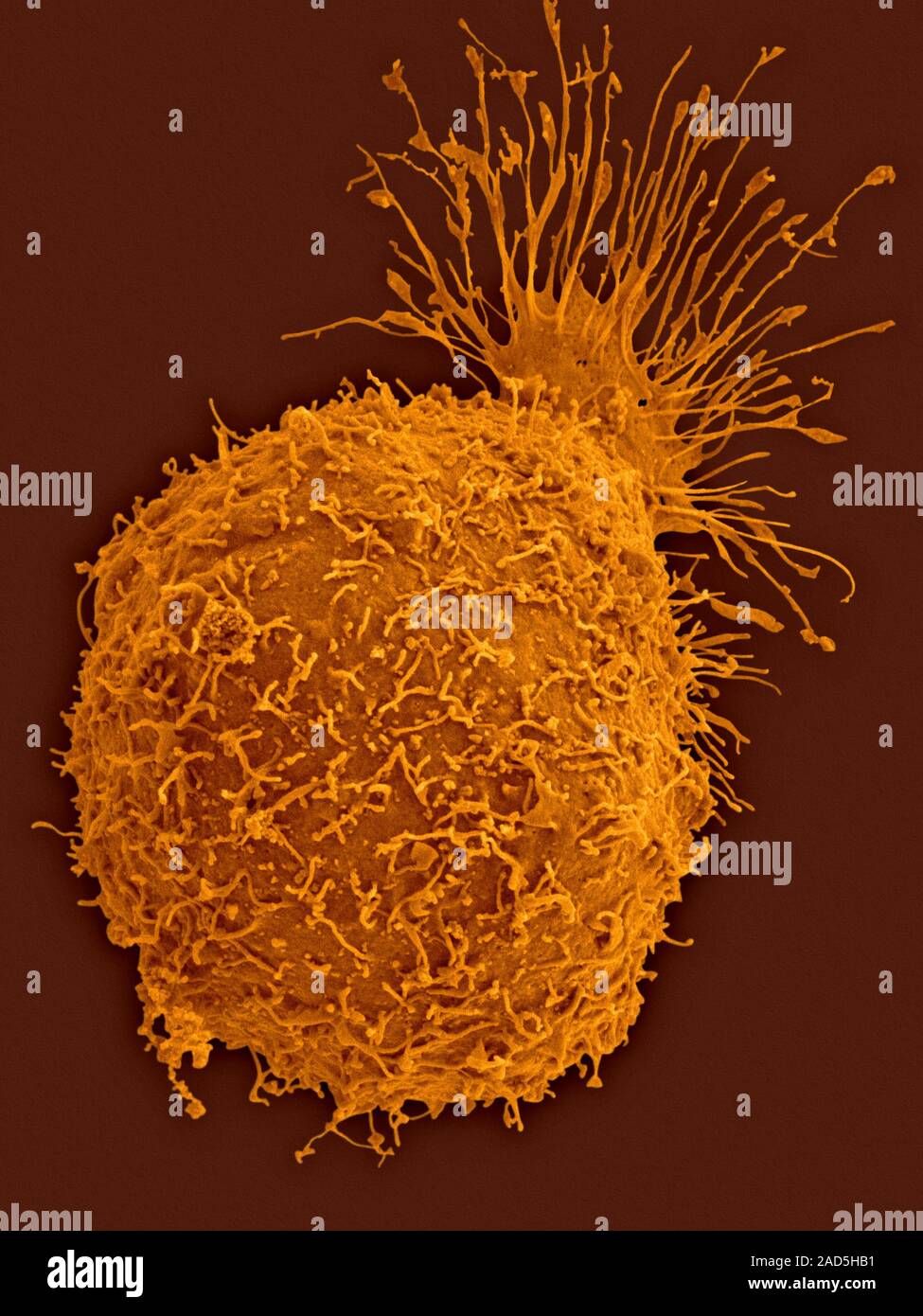 Coloured scanning electron micrograph (SEM) of an insect ovary cell ...