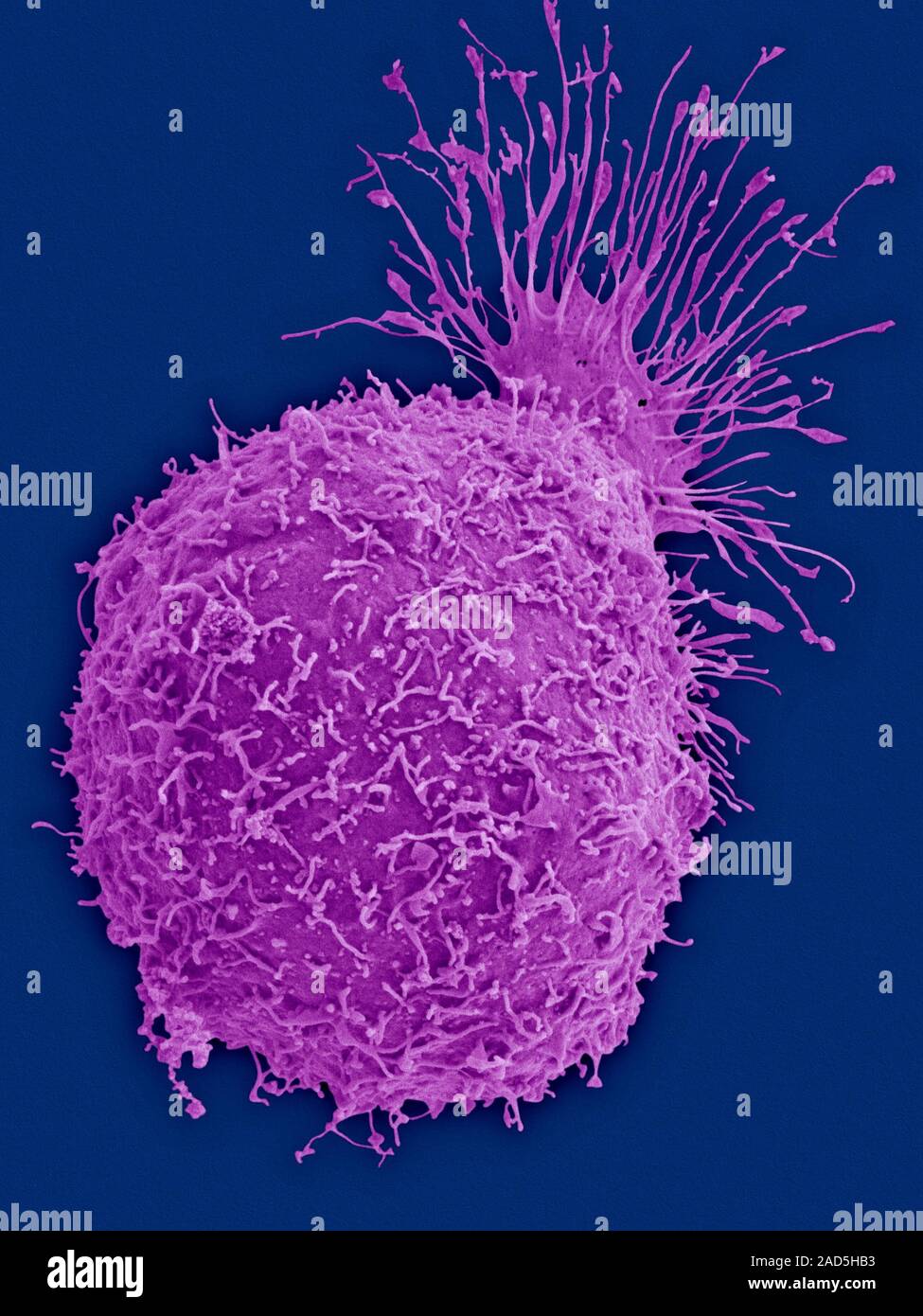 Coloured scanning electron micrograph (SEM) of an insect ovary cell ...