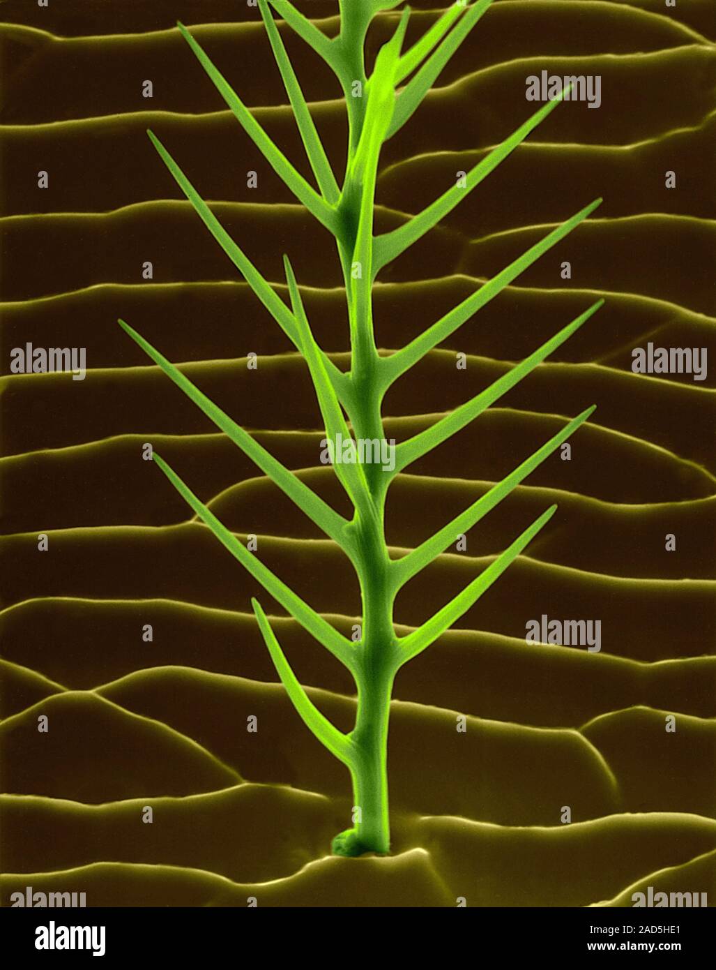 Coloured scanning electron micrograph (SEM) of Exoskeleton branched ...
