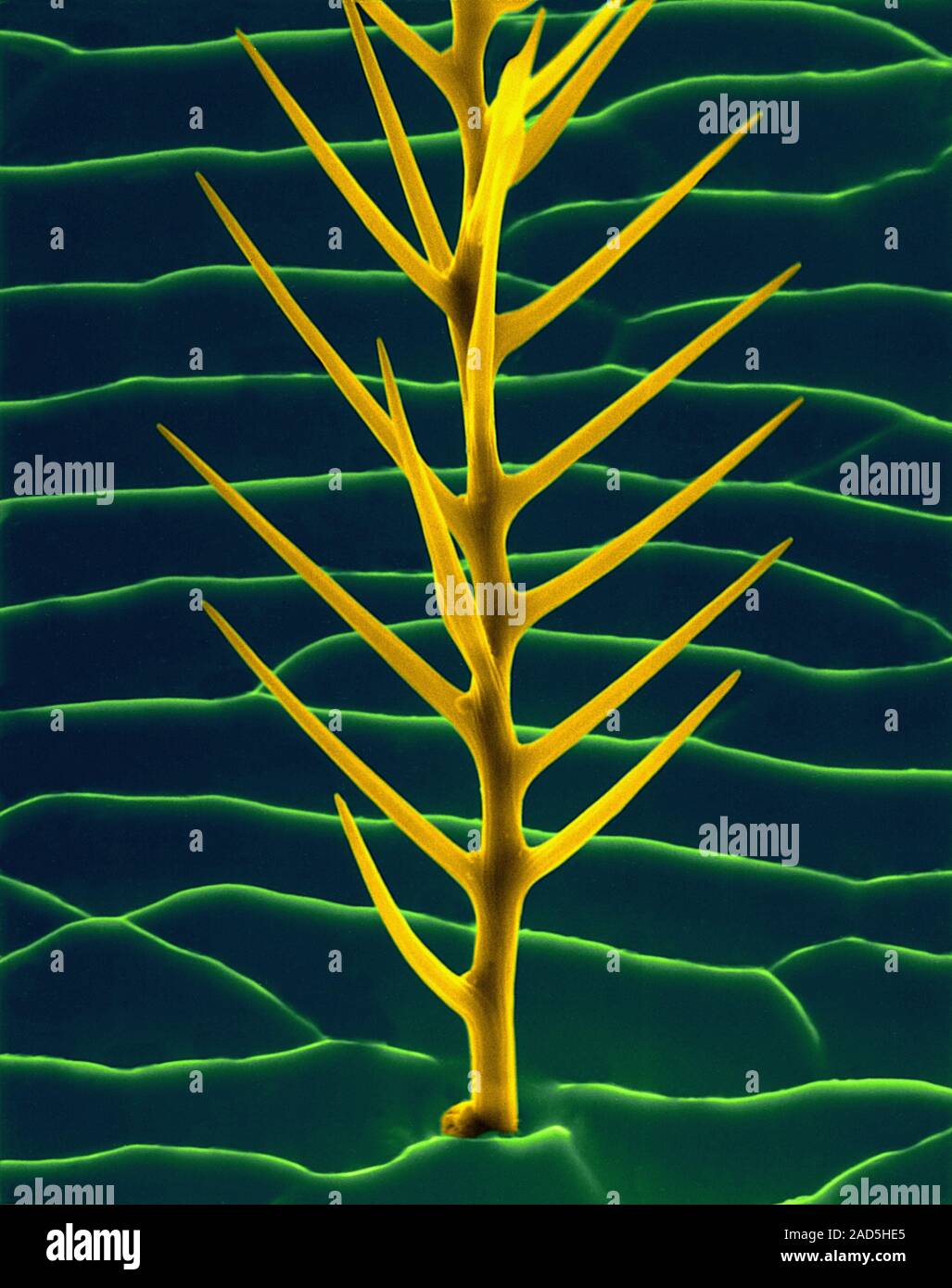 Coloured scanning electron micrograph (SEM) of Exoskeleton branched ...