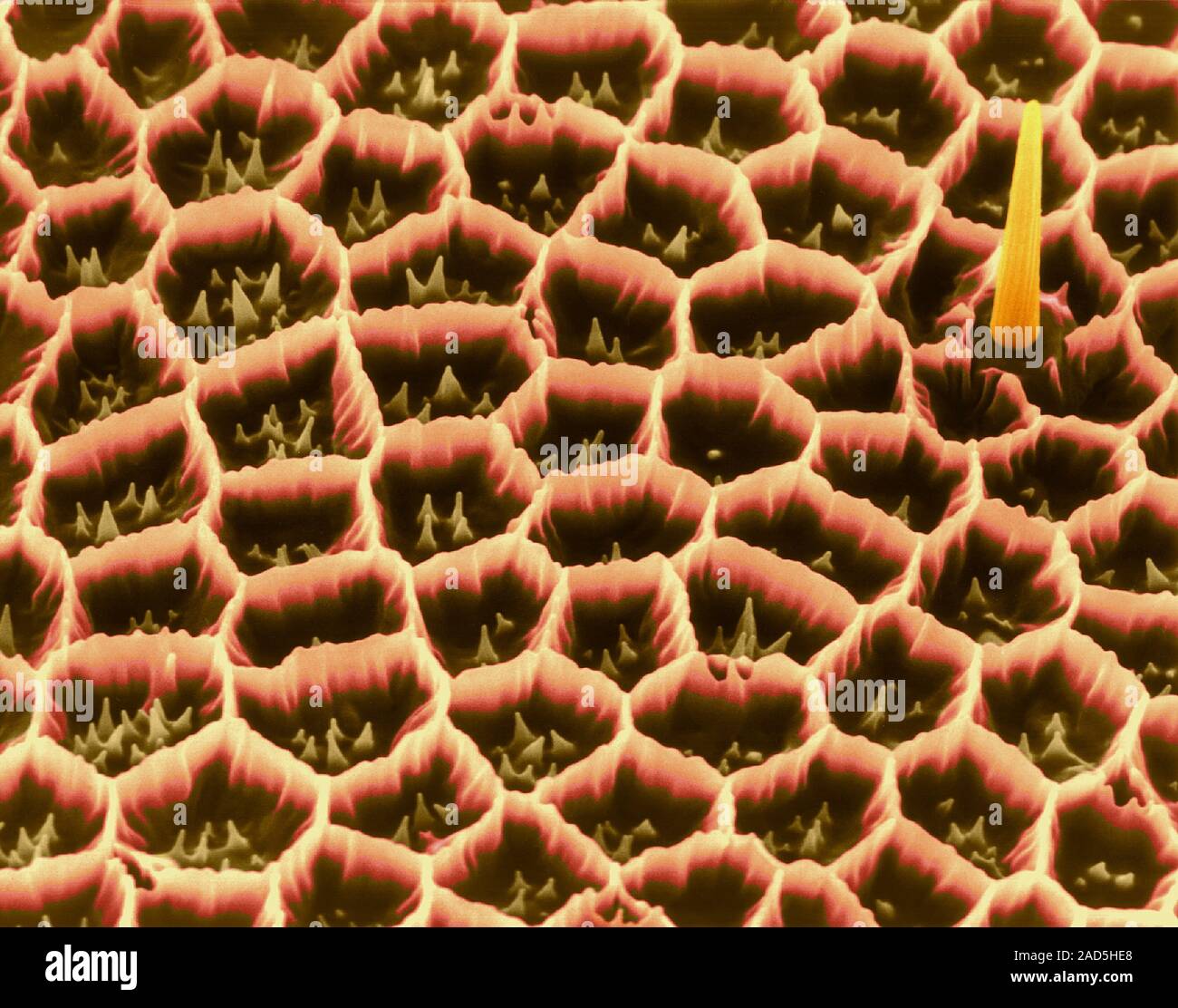 Coloured scanning electron micrograph (SEM) of Grasshopper thorax ...