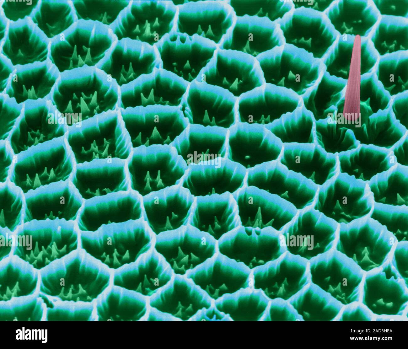 Coloured scanning electron micrograph (SEM) of Grasshopper thorax ...