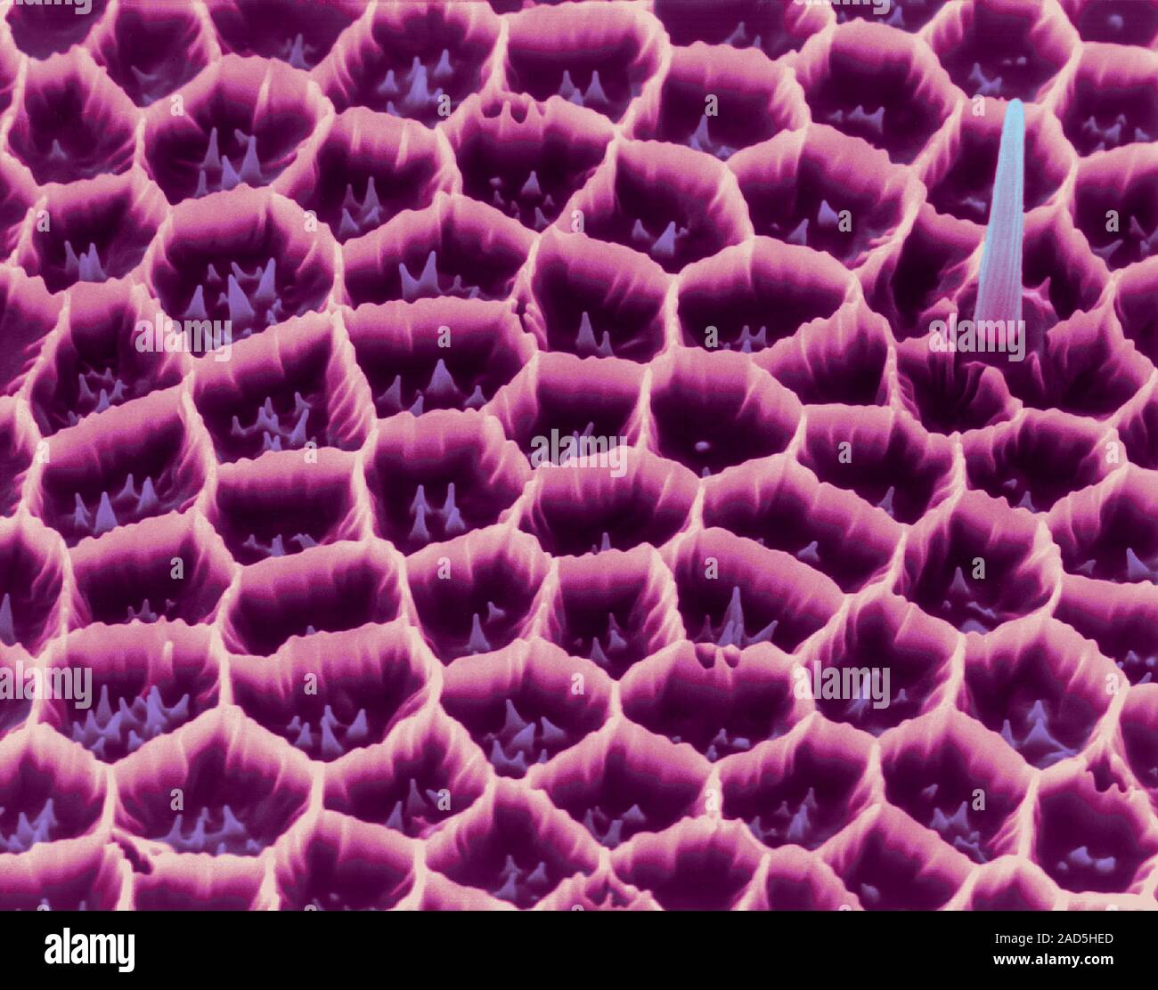 Coloured scanning electron micrograph (SEM) of Grasshopper thorax ...