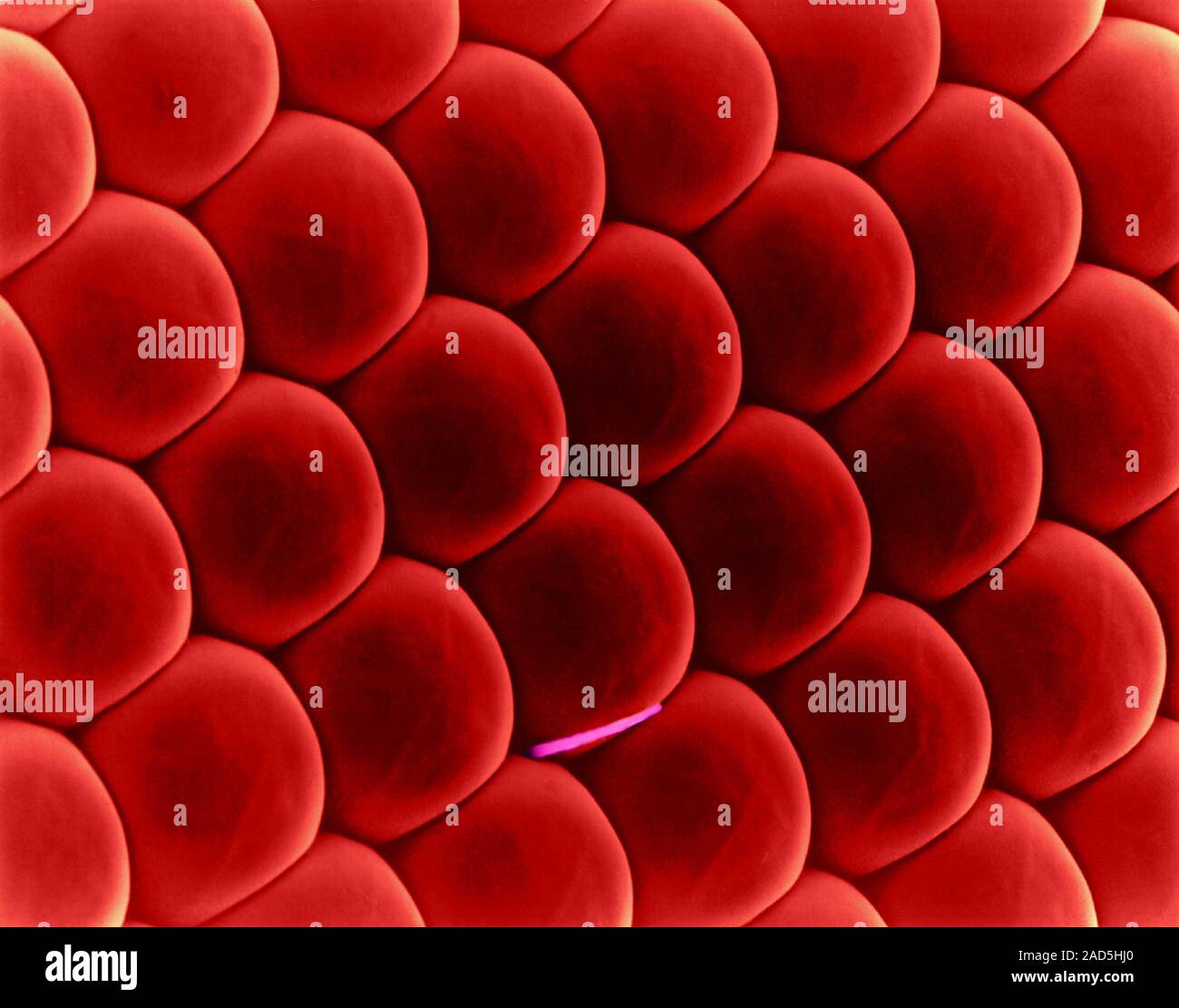 Coloured scanning electron micrograph (SEM) of House fly compound eye ...