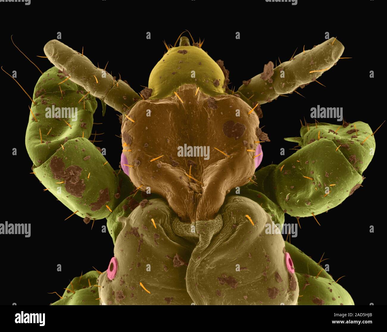 Coloured scanning electron micrograph (SEM) of Human head louse ...