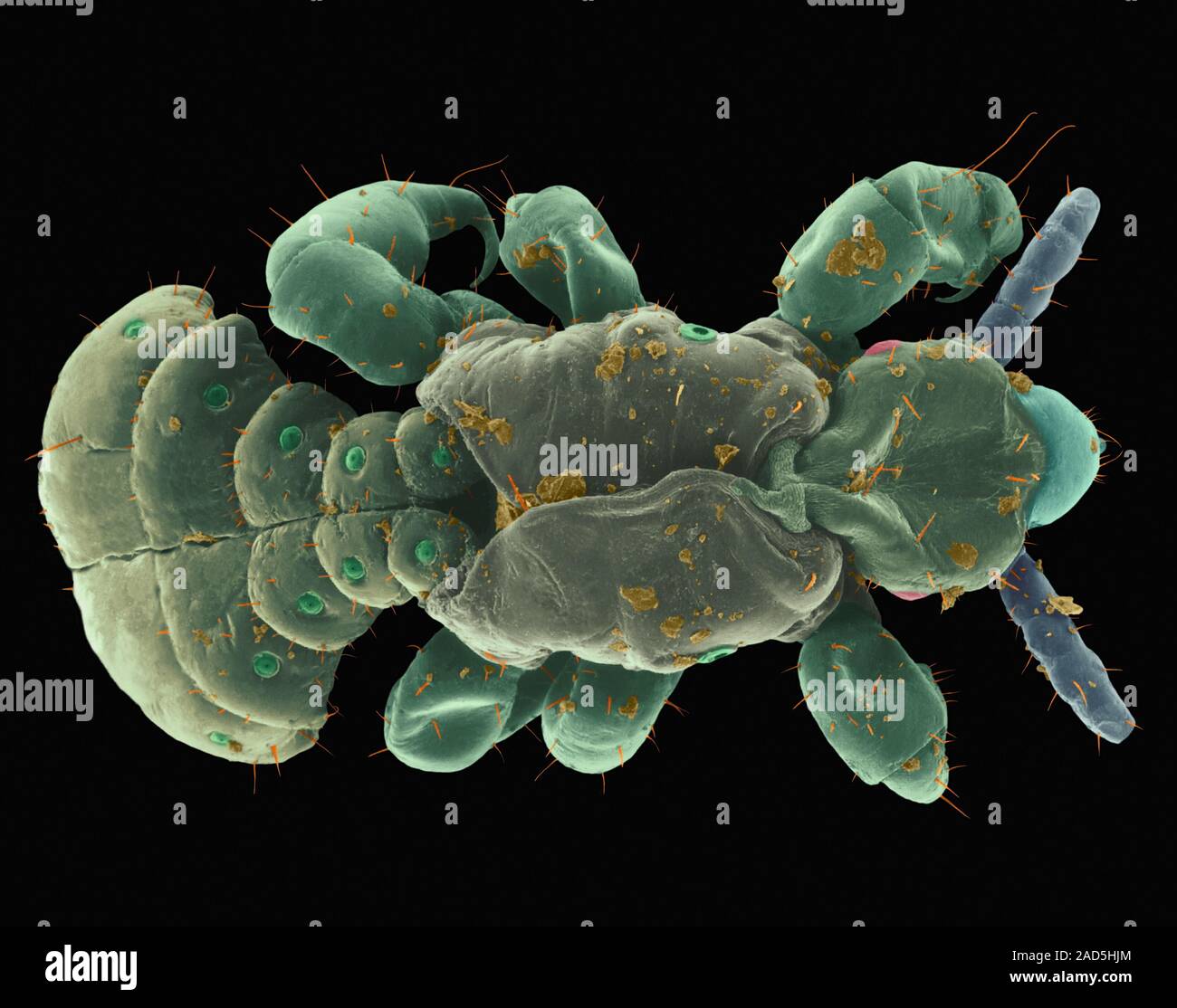 Coloured scanning electron micrograph (SEM) of Human head louse ...