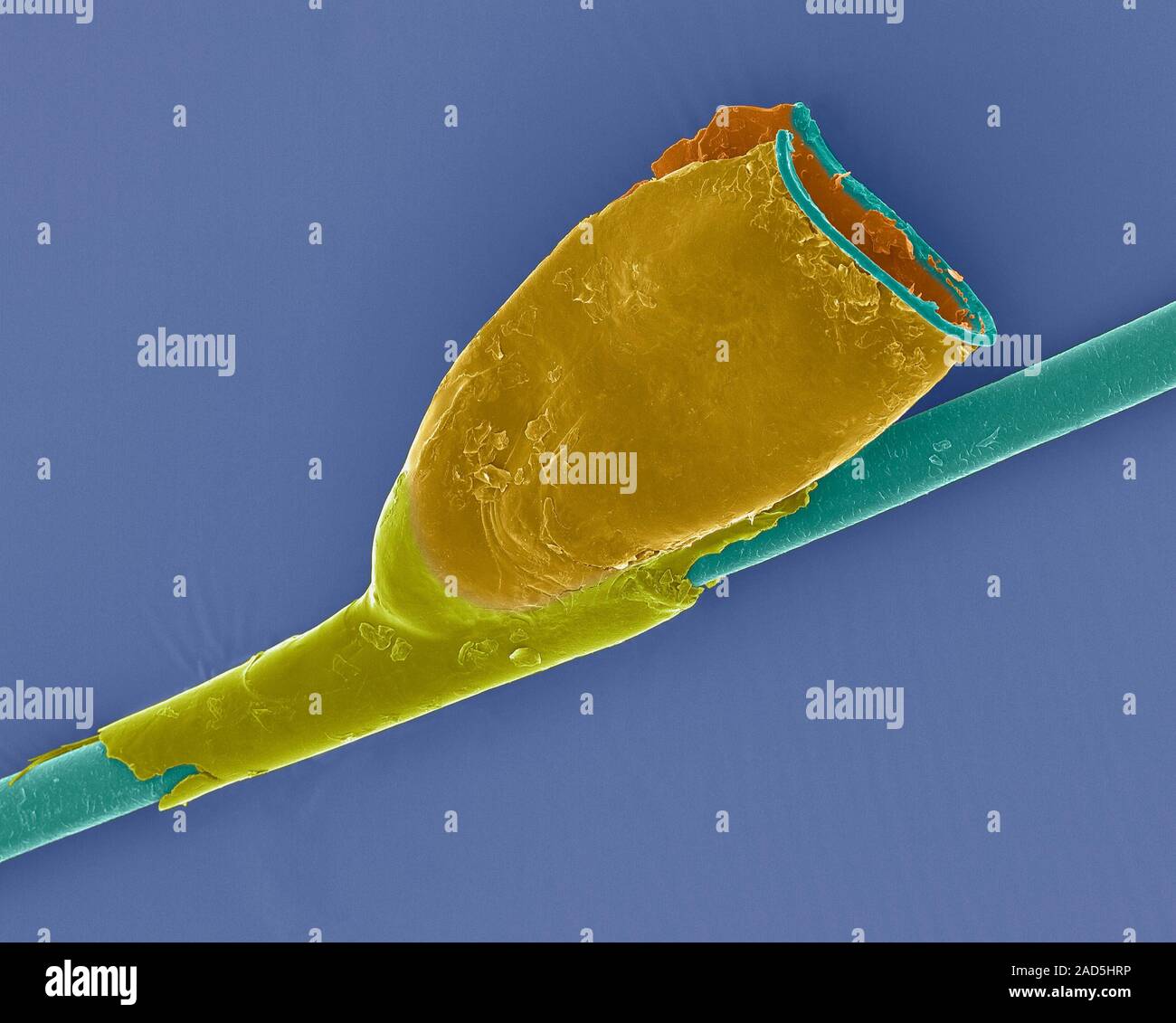 Coloured scanning electron micrograph (SEM) of Human head louse egg ...