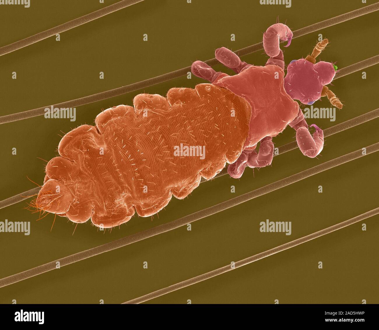 Coloured scanning electron micrograph (SEM) of Human head louse on ...