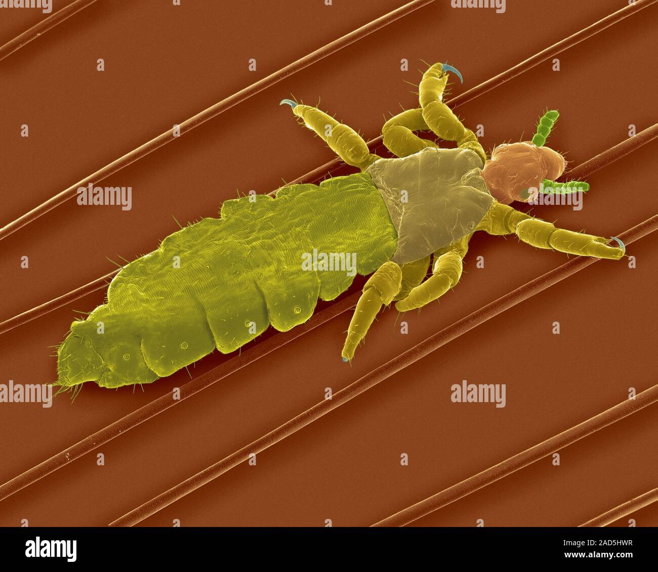 Coloured scanning electron micrograph (SEM) of Human head louse on ...