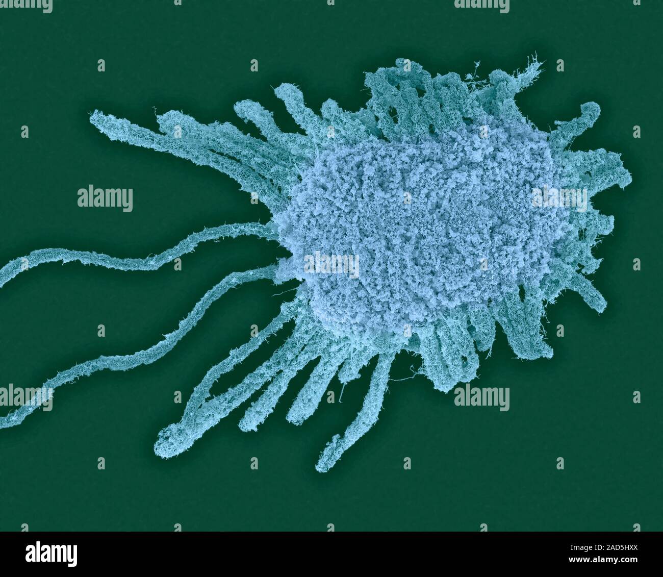 Coloured scanning electron micrograph (SEM) of Whitefly larva ...