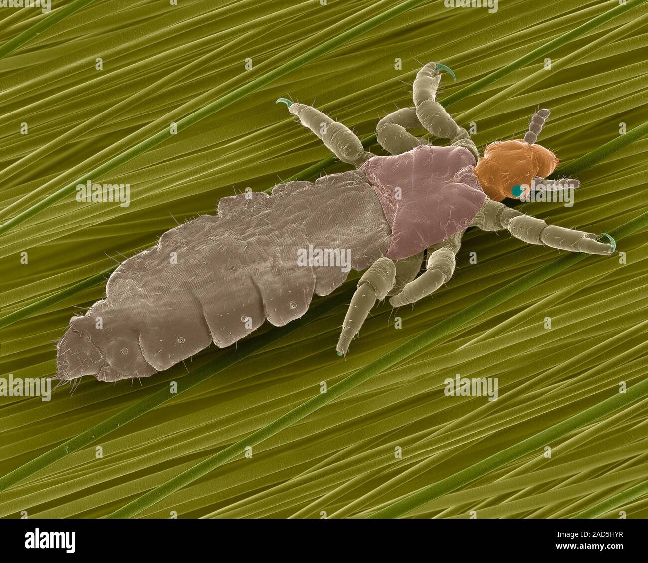 Coloured scanning electron micrograph (SEM) of Human head louse on ...