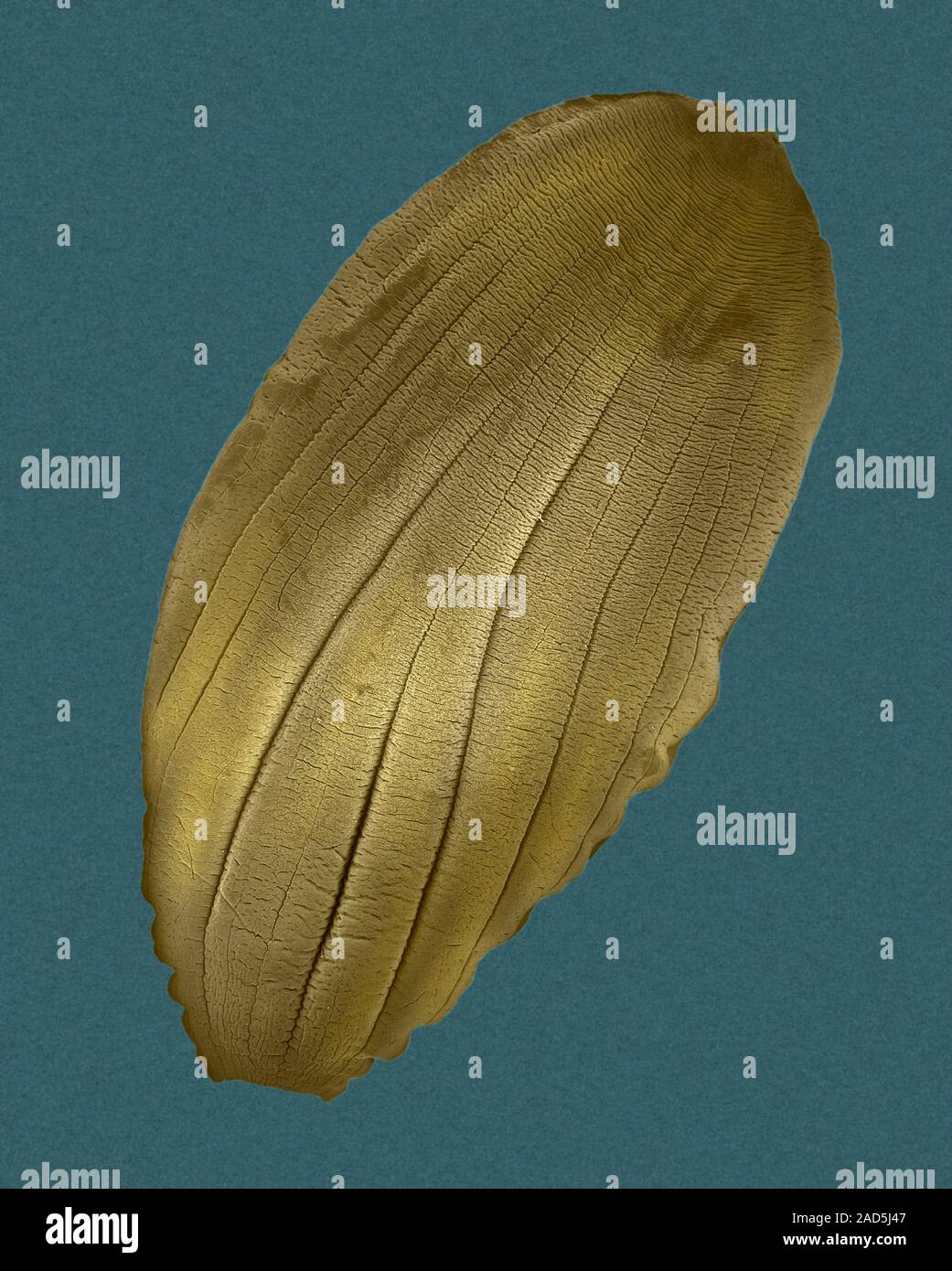 Coloured scanning electron micrograph (SEM) of Dog tapeworm proglottid ...