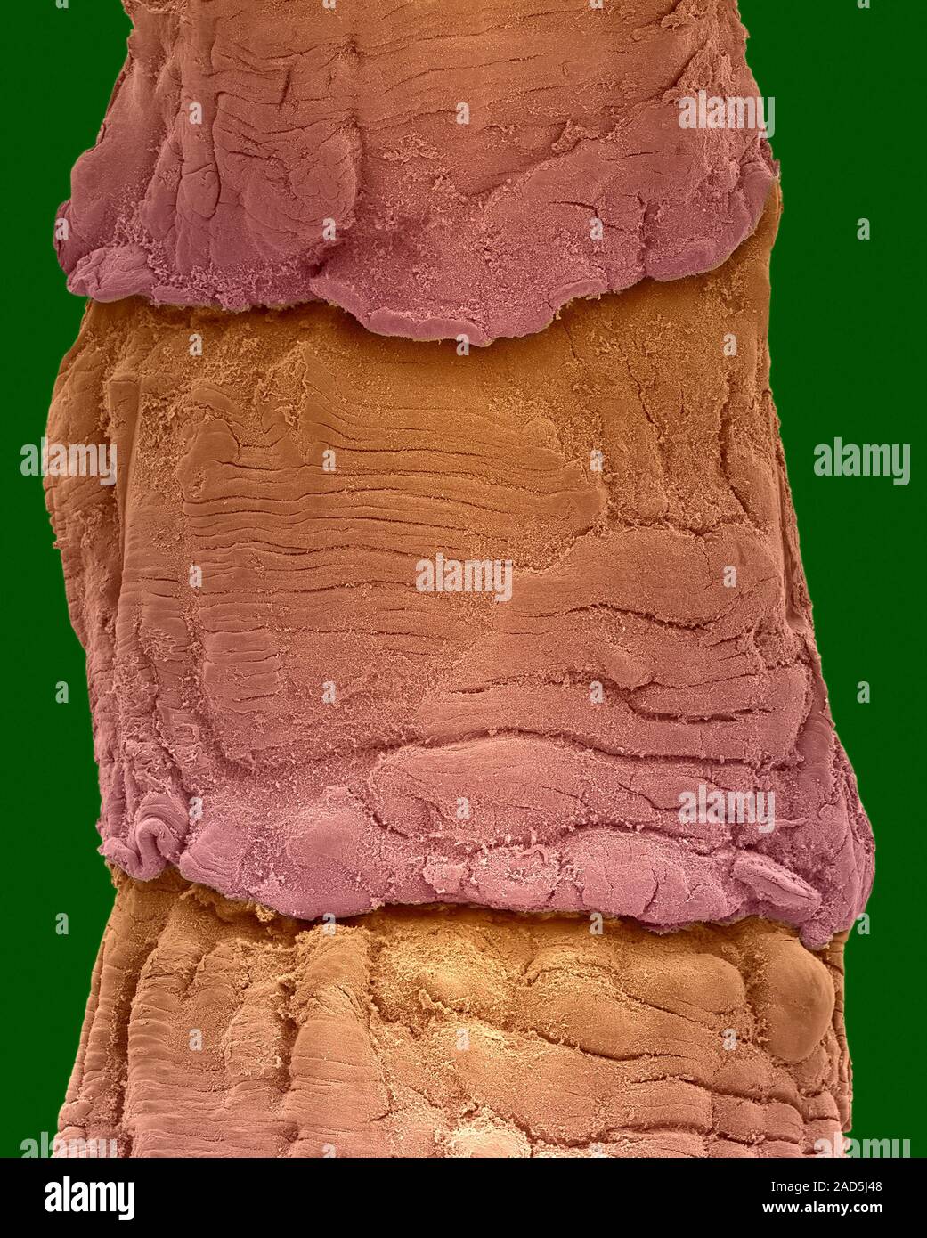 Coloured scanning electron micrograph (SEM) of Intestinal tapeworm ...