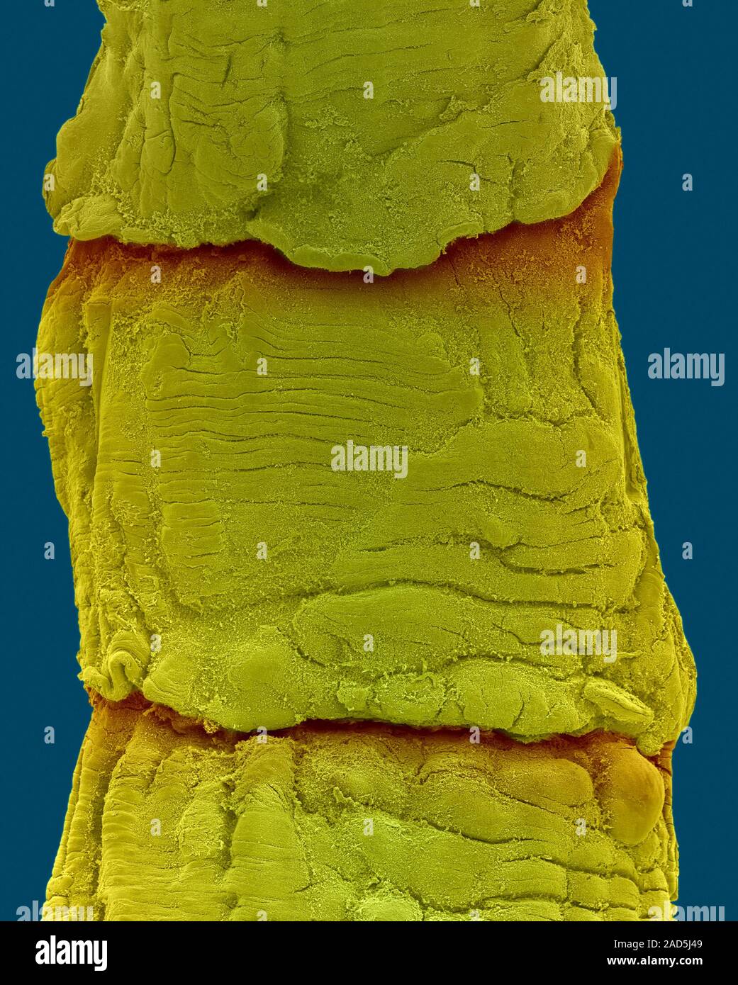 Coloured scanning electron micrograph (SEM) of Intestinal tapeworm ...