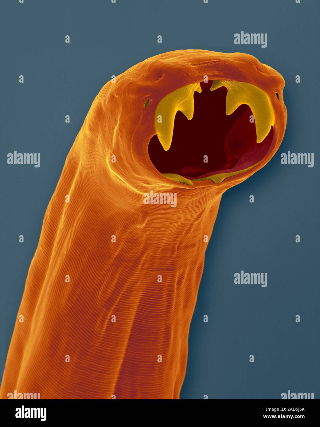 Coloured scanning electron micrograph (SEM) of Cat hookworm buccal cavity (Ancylostoma ...