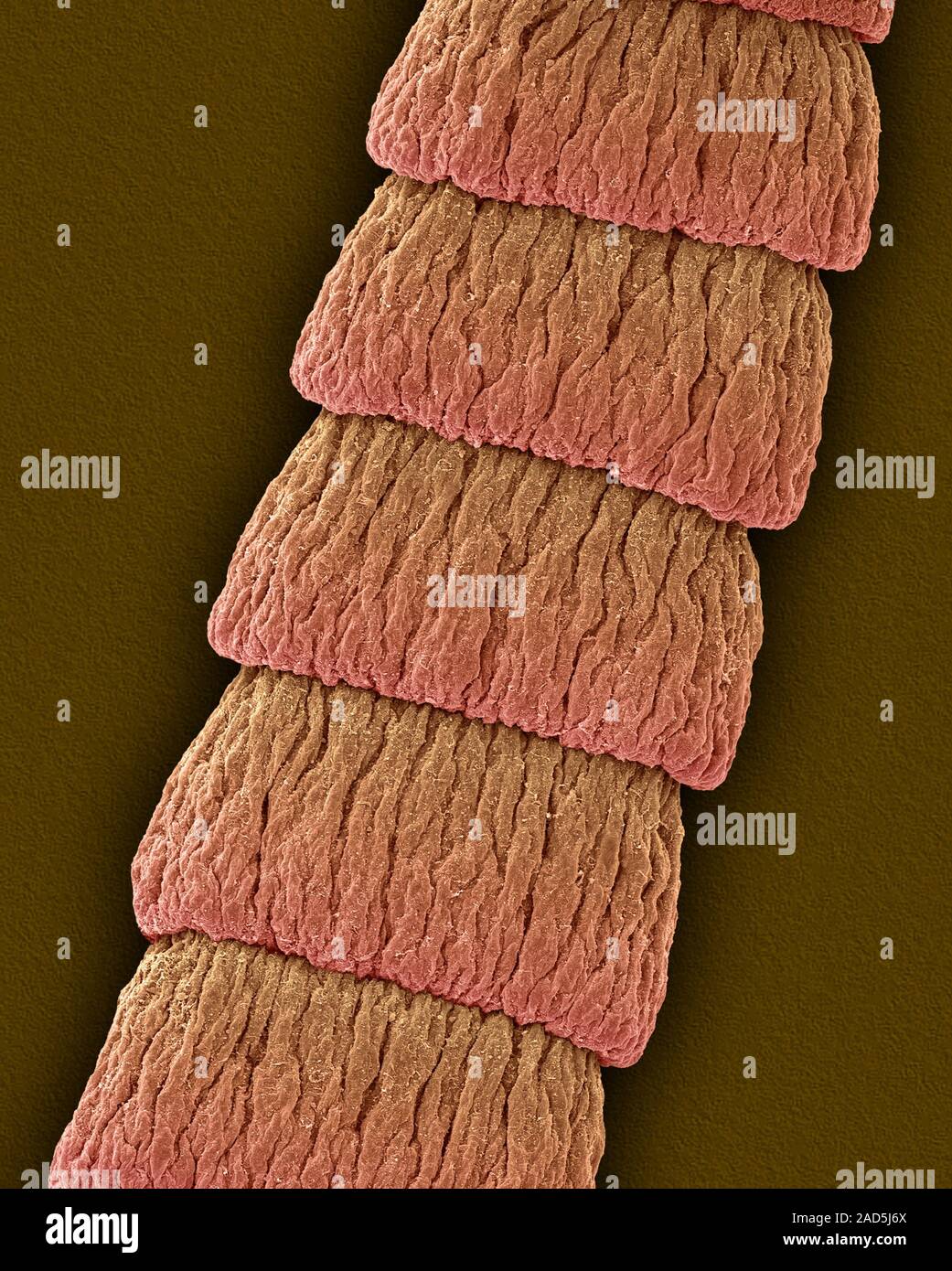 Coloured scanning electron micrograph (SEM) of Dog tapeworm proglottids ...