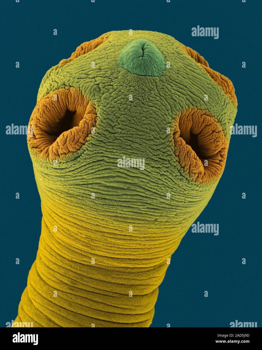 Coloured scanning electron micrograph (SEM) of Dog tapeworm scolex ...