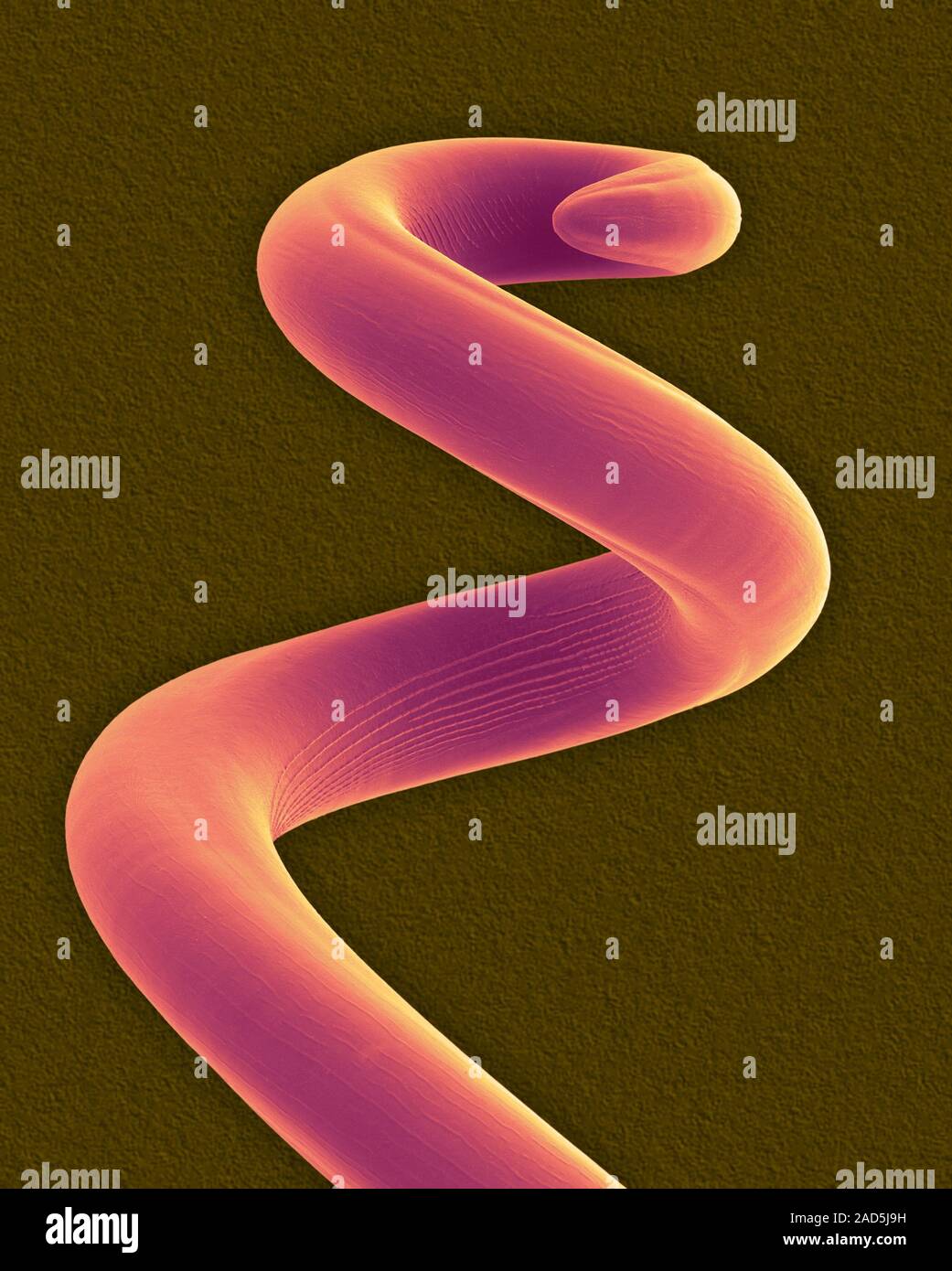 Coloured scanning electron micrograph (SEM) of Dog heartworm ...