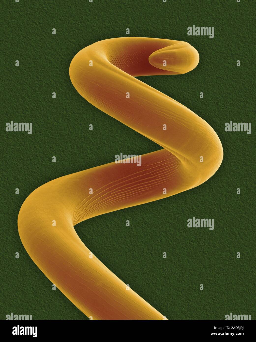 Coloured scanning electron micrograph (SEM) of Dog heartworm ...