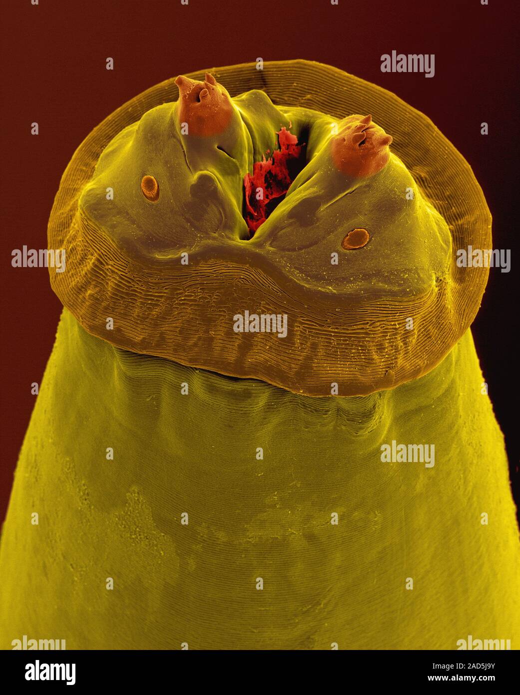 Coloured scanning electron micrograph (SEM) of Raccoon intestinal ...