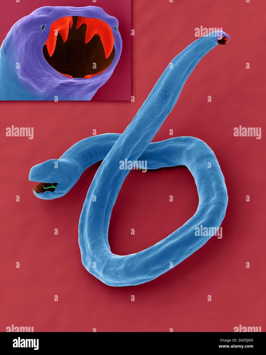 Coloured scanning electron micrograph (SEM) of Dog hookworm (nematode ...