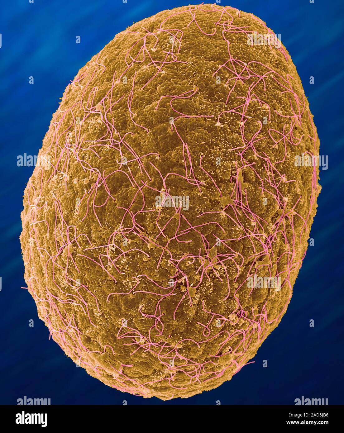 Coloured scanning electron micrograph (SEM) of Larva stage (planula) of ...