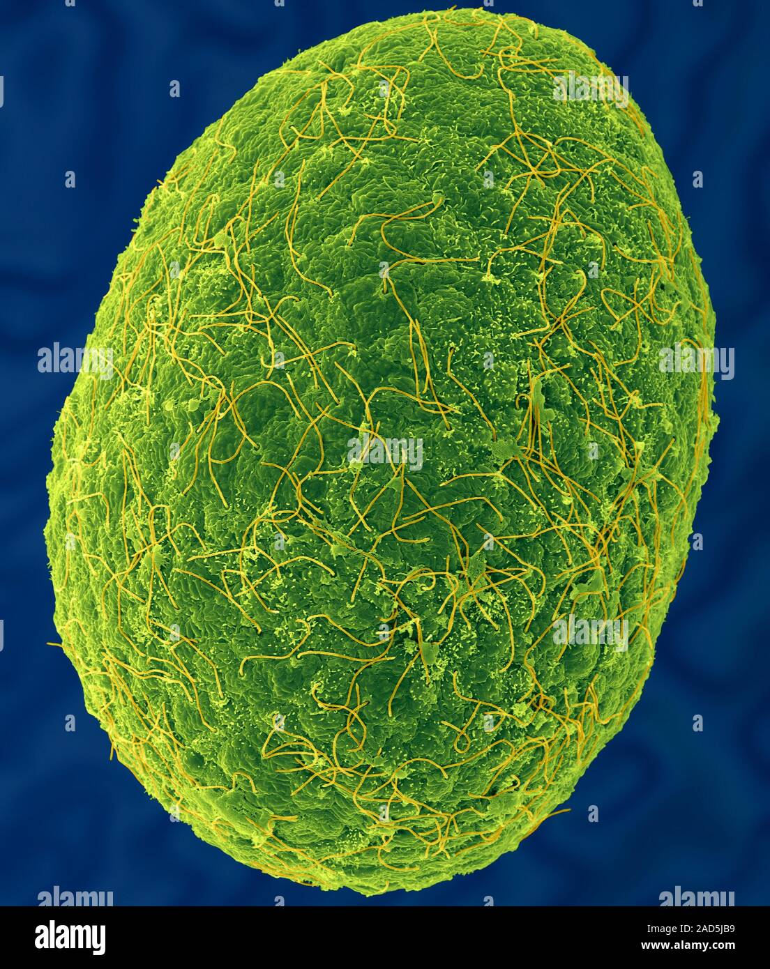 Coloured scanning electron micrograph (SEM) of Larva stage (planula) of ...