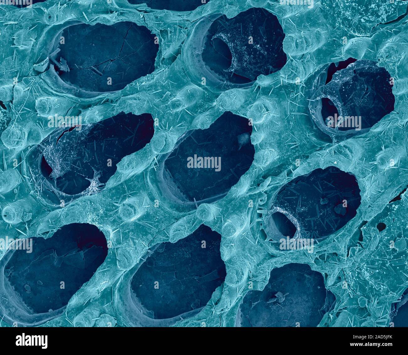 Coloured scanning electron micrograph (SEM) of Bryozoan, lophophorate ...