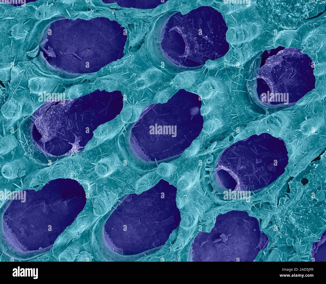 Coloured scanning electron micrograph (SEM) of Bryozoan, lophophorate ...