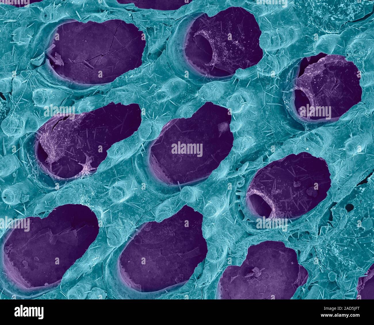 Coloured scanning electron micrograph (SEM) of Bryozoan, lophophorate ...