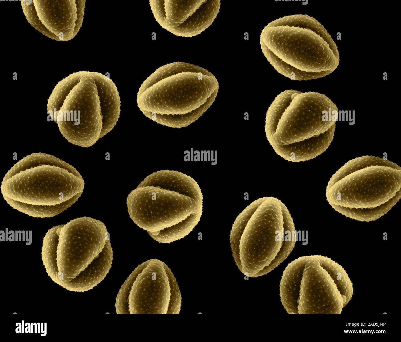Sagebrush pollen; an allergen (Artemisia tridentata), coloured scanning ...
