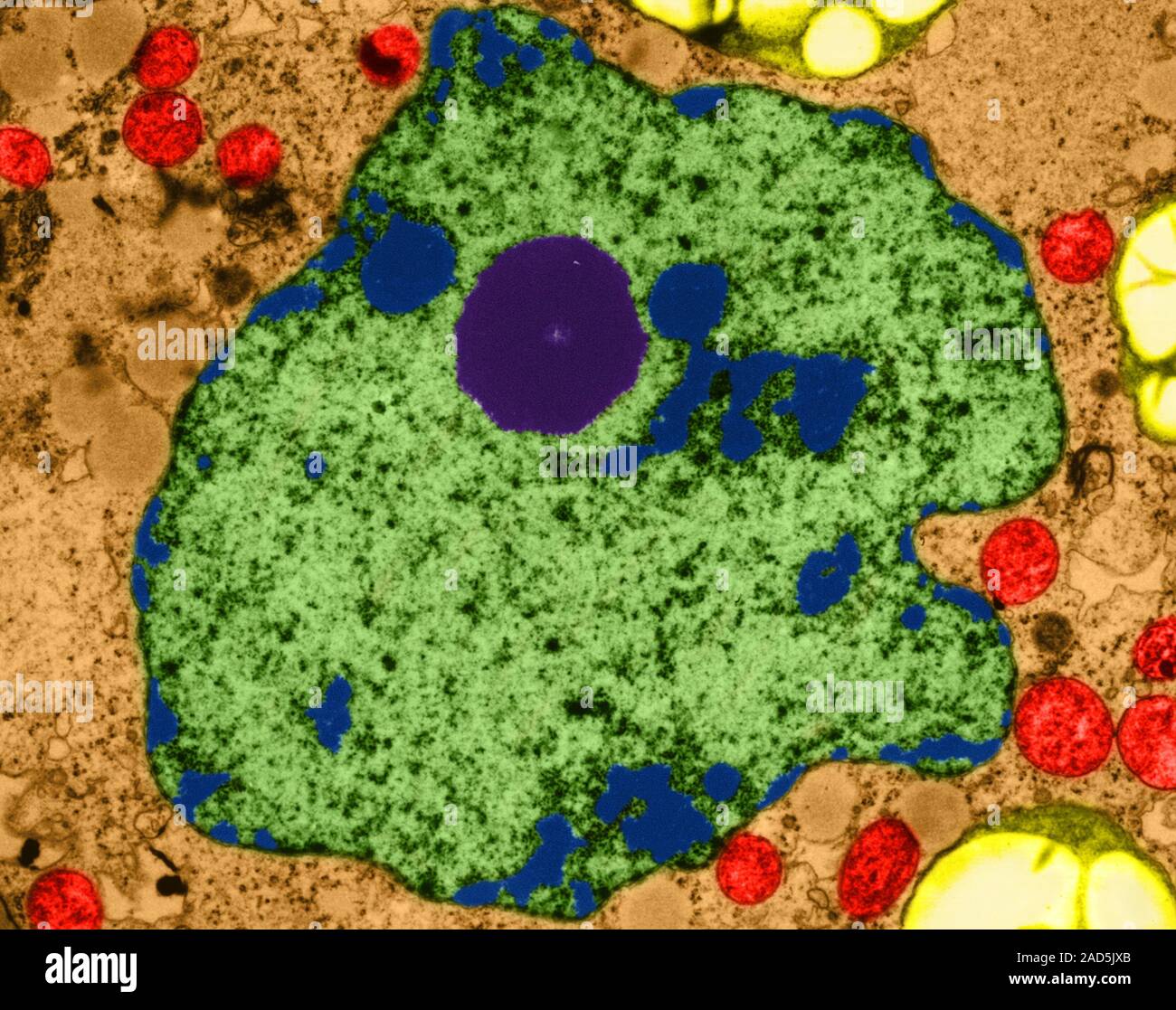 Plant parenchyma cell nucleus (arum or voodoo lily, Sauromatum guttatum ...
