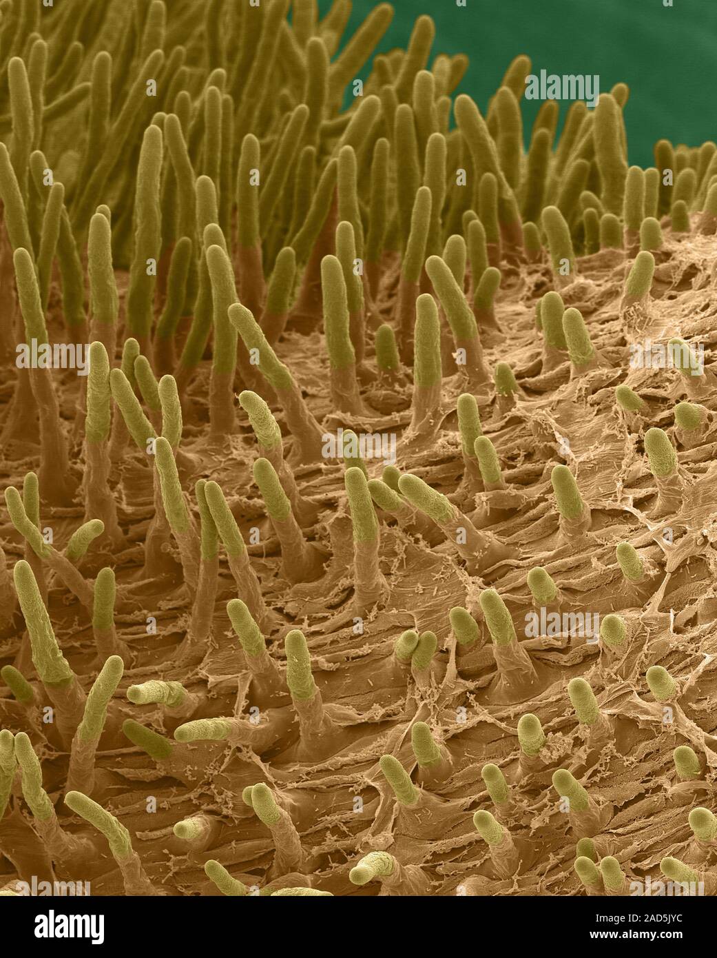 Radish seed germination (Raphanus sativus), coloured scanning electron ...