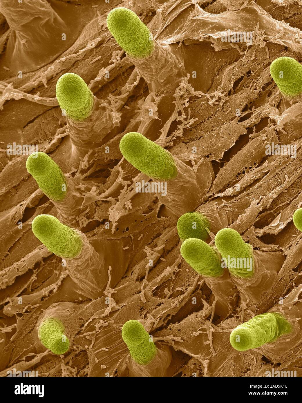 Radish seed germination (Raphanus sativus), coloured scanning electron ...