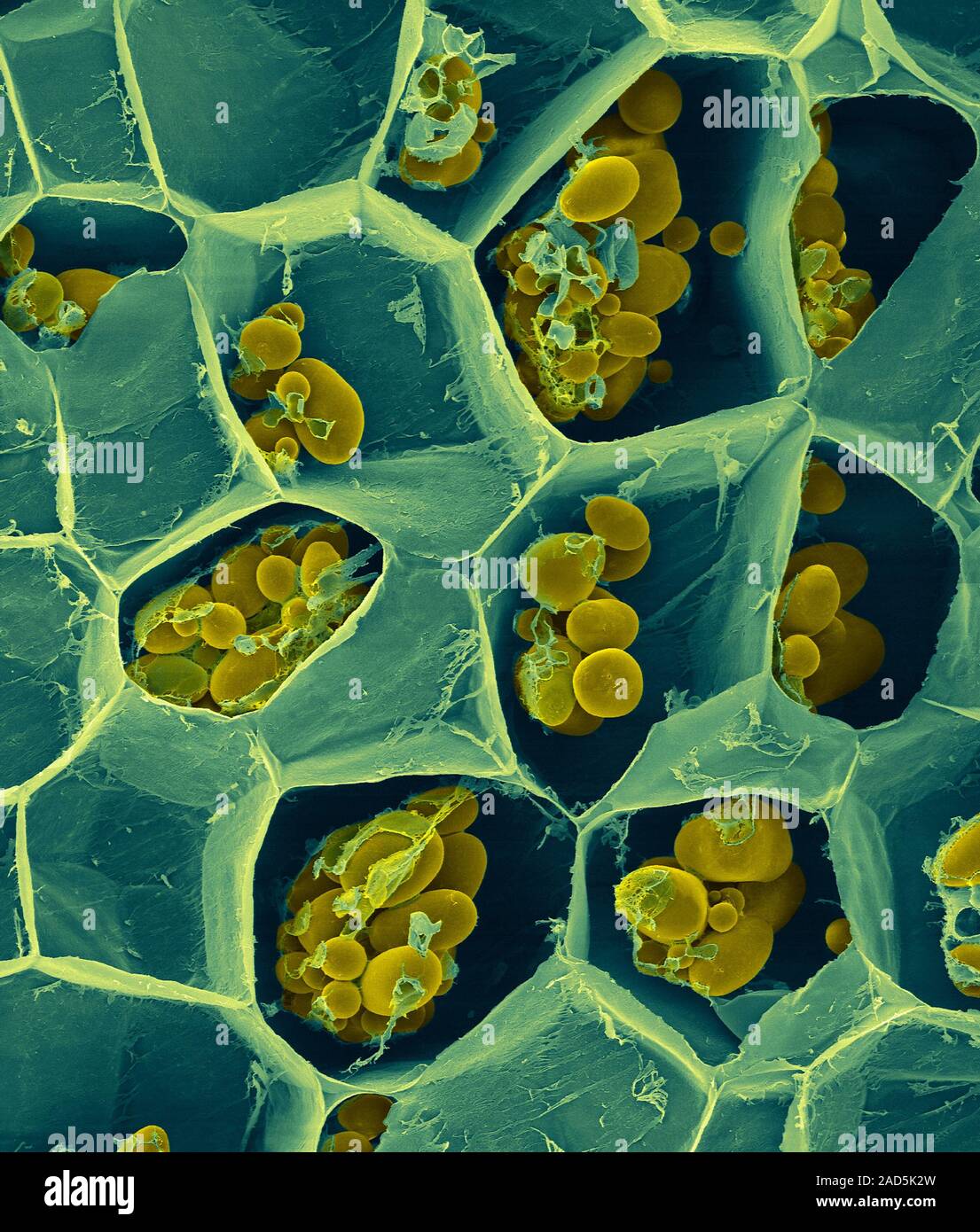 Starch Grains In Raw Potato Cells Coloured Scanning Electron Micrograph Sem A Slice Through