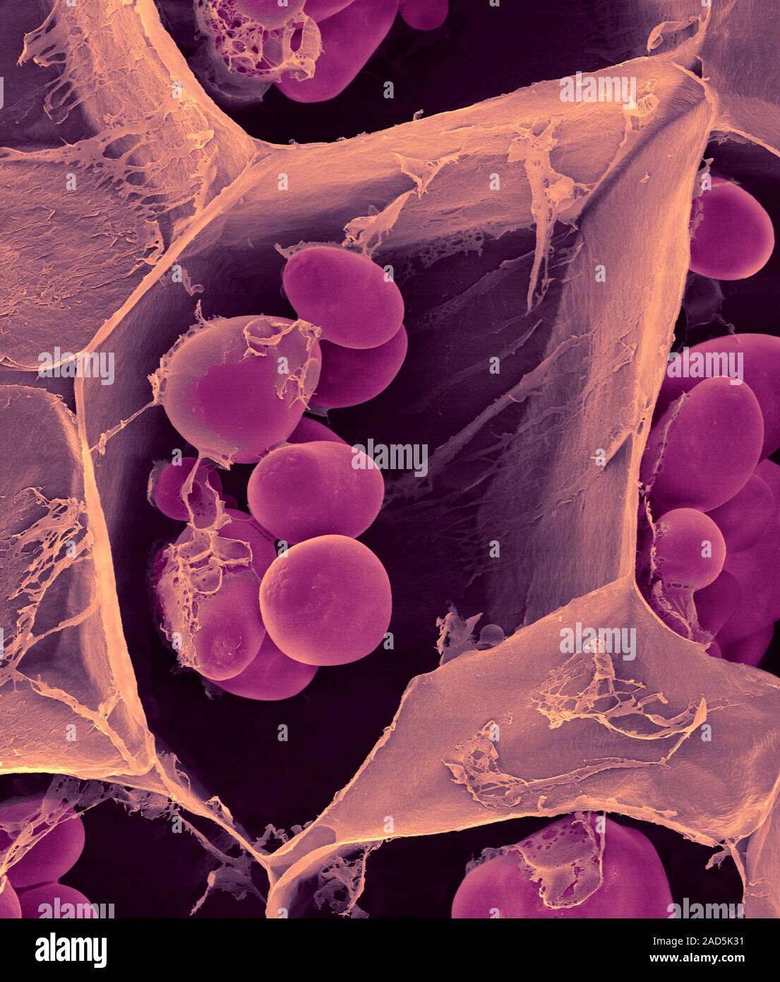 Starch grains in raw potato cells, coloured scanning electron ...
