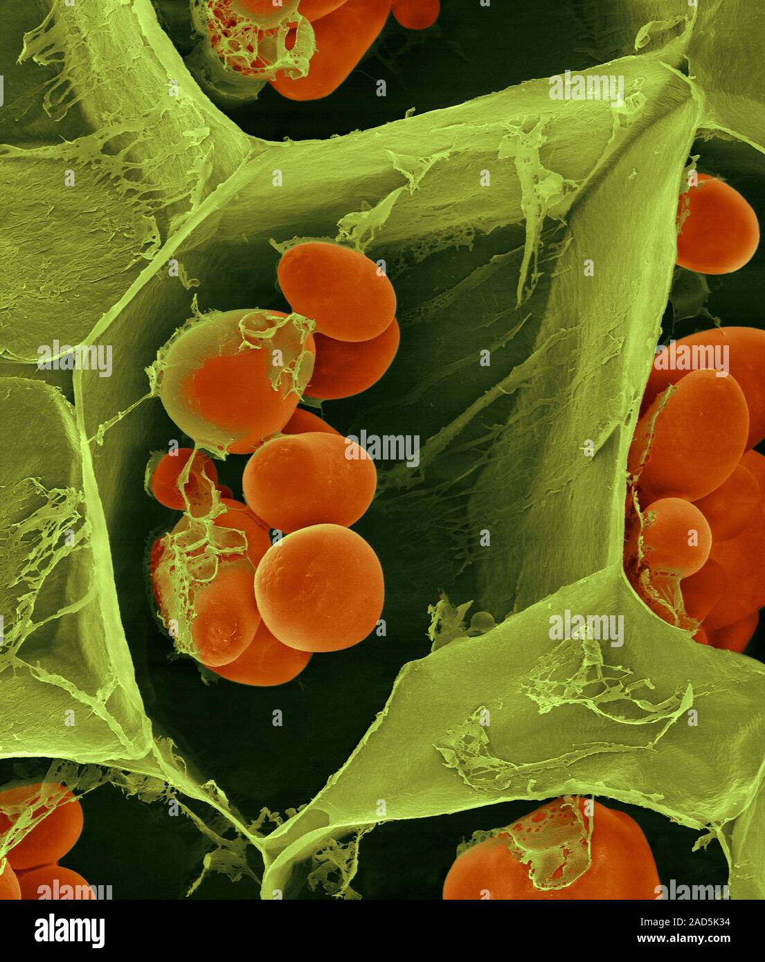 Starch grains in raw potato cells, coloured scanning electron ...