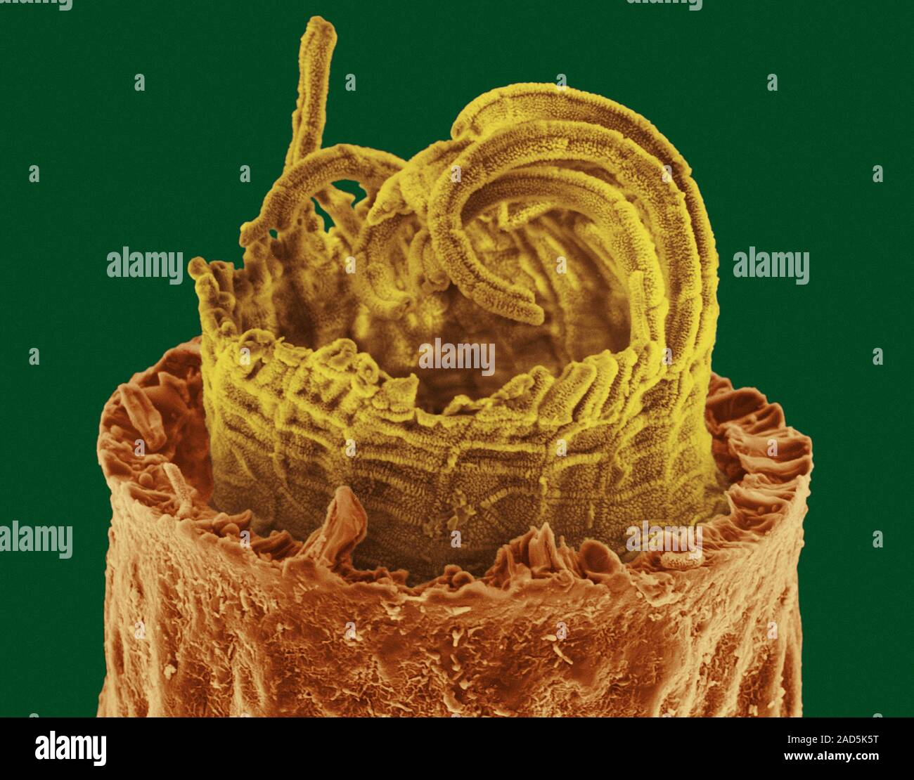 Moss (sporophyte) spore capsule showing the opening through which ...