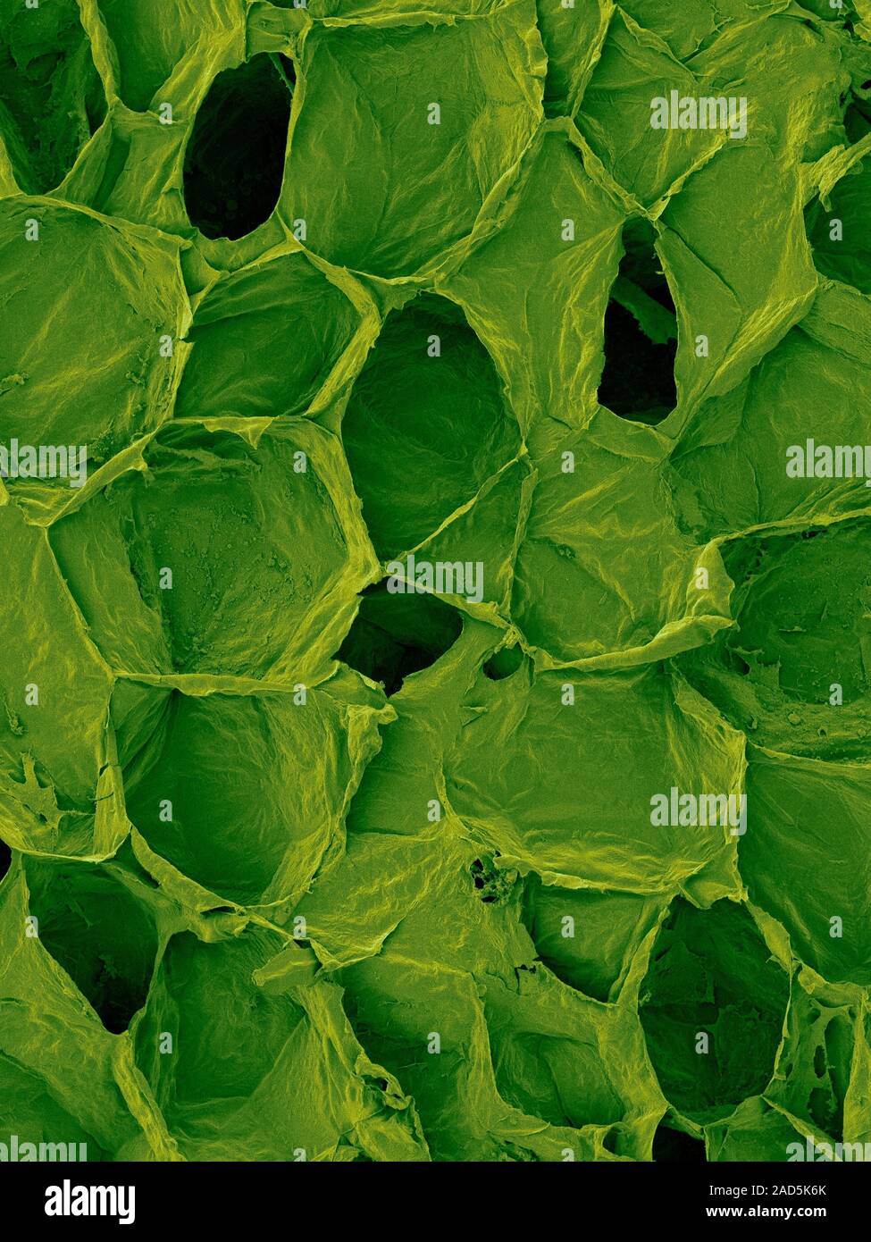 Green bean inner bean pod parenchyma cells (Phaseolus vulgaris; Blue ...