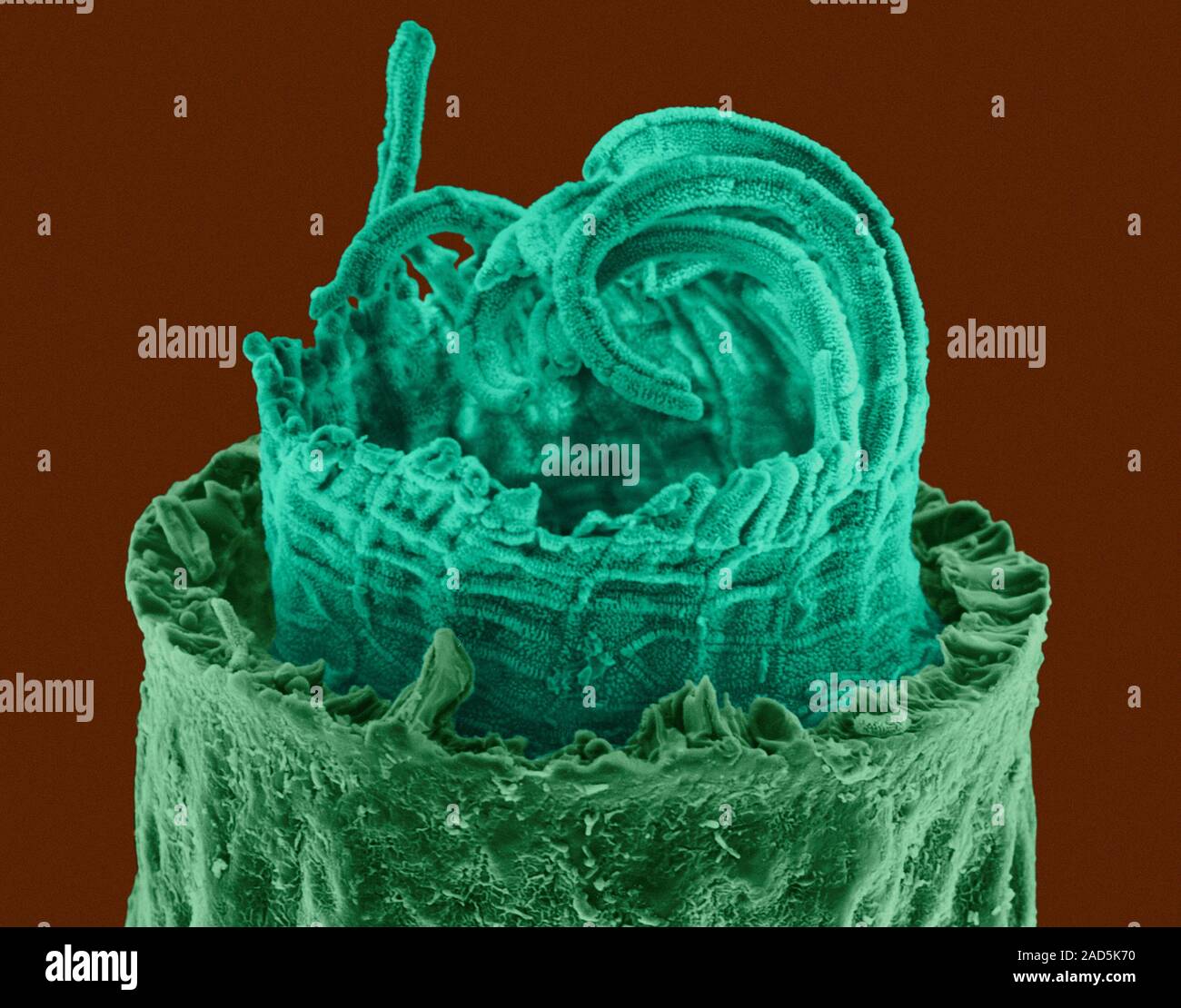 Moss (sporophyte) spore capsule showing the opening through which ...