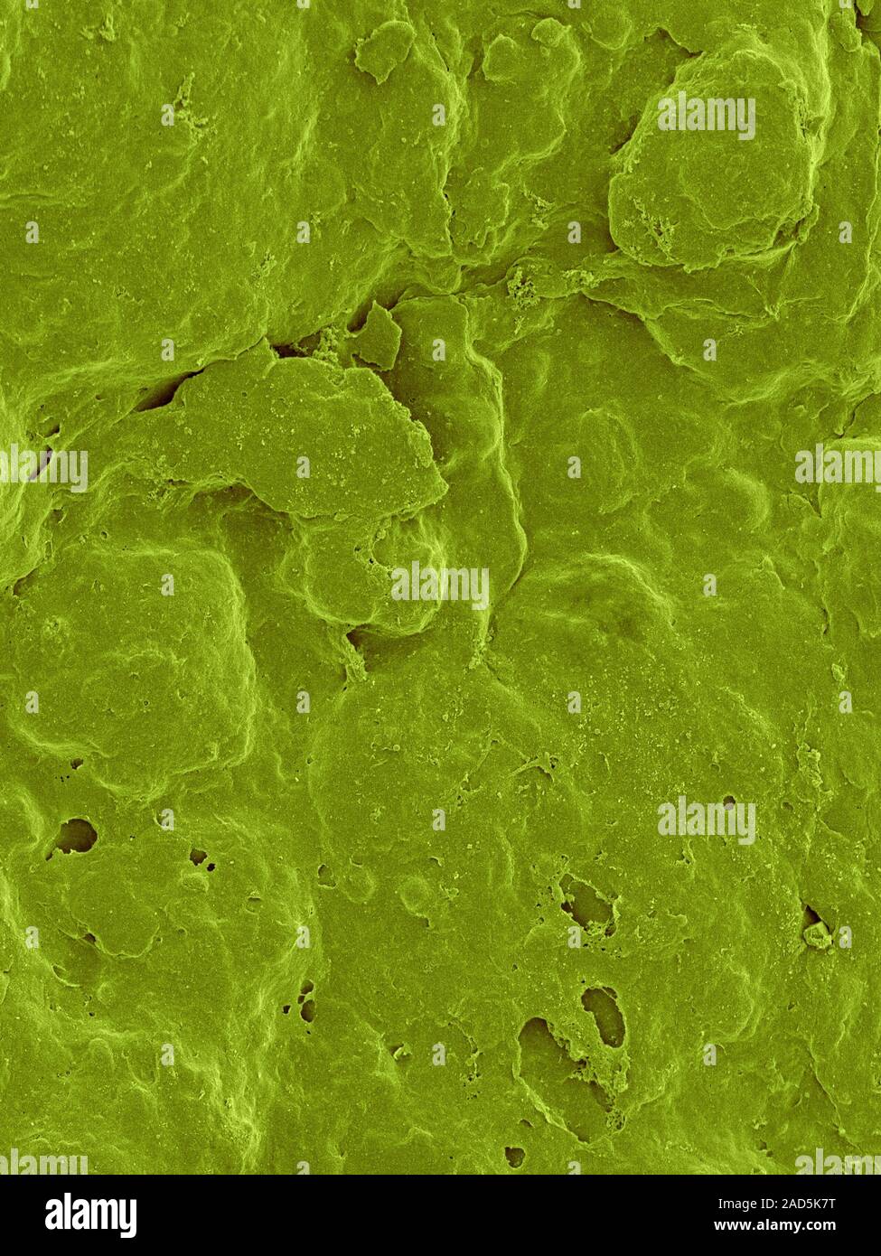 Surface of a lemon peel (Citrus limon), coloured scanning electron micrograph (SEM). Lemons are ...